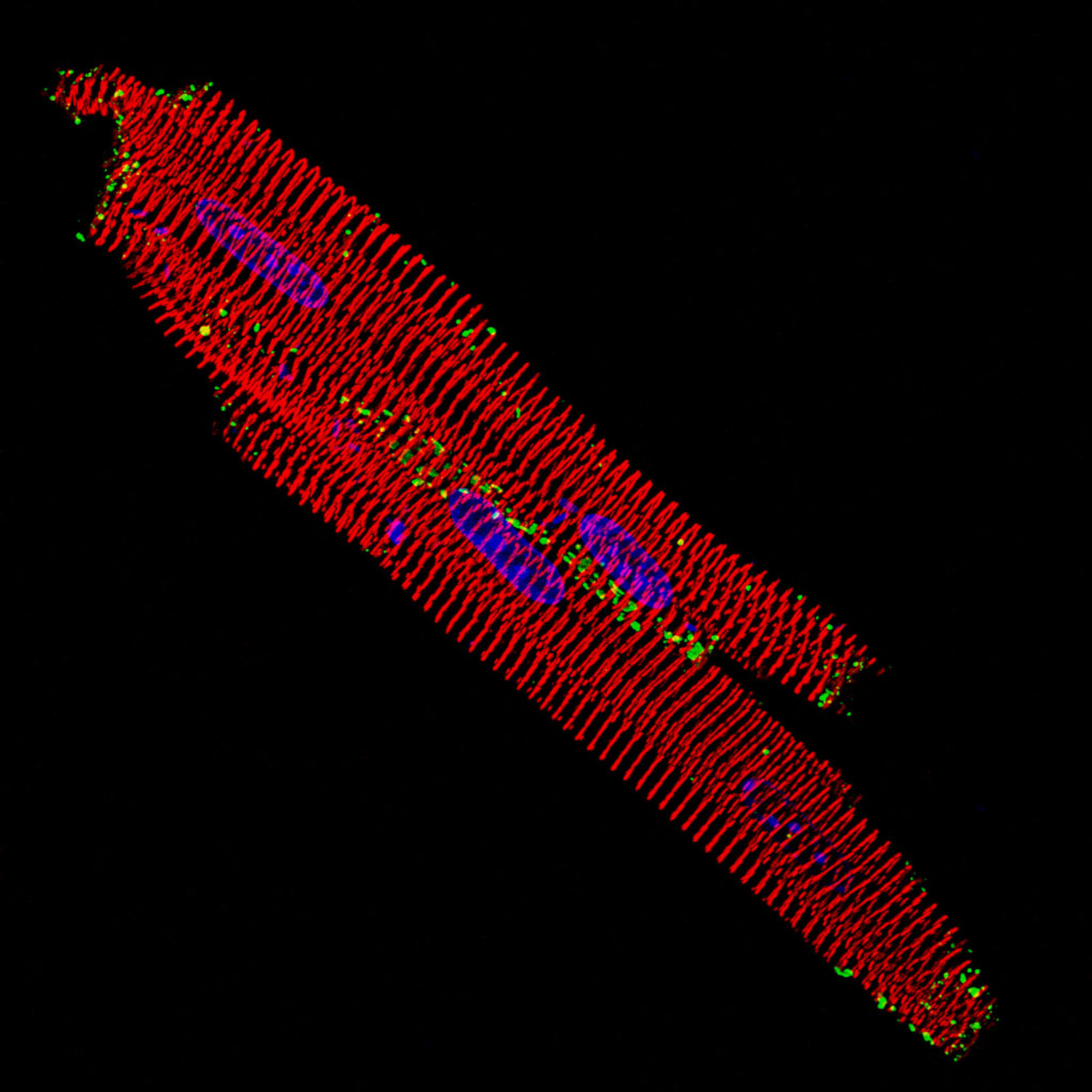 Mouse cardiac ventricular myocytes (isolated heart muscle cells ...