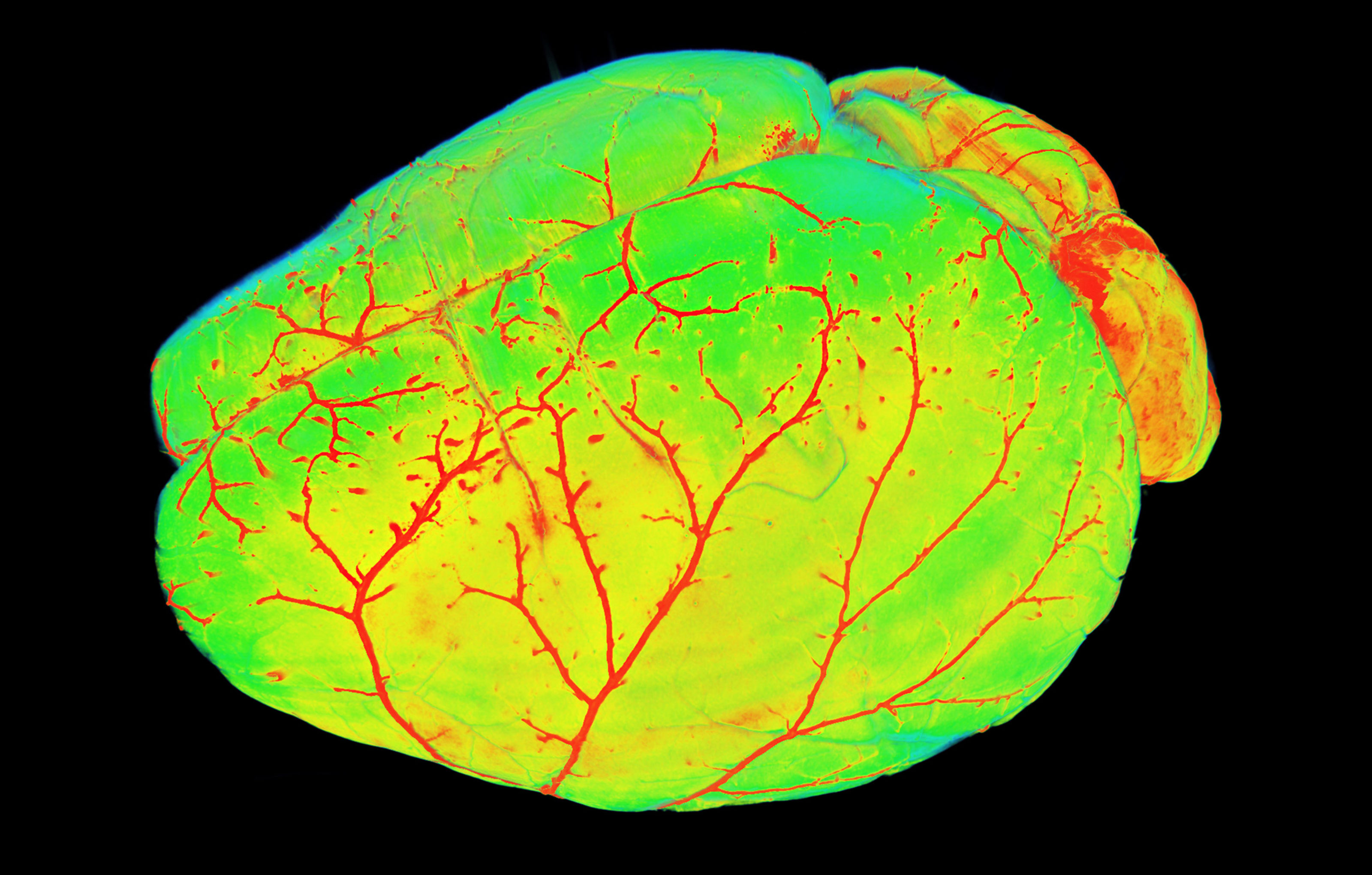 Mouse brain vasculature | Nikon Small World