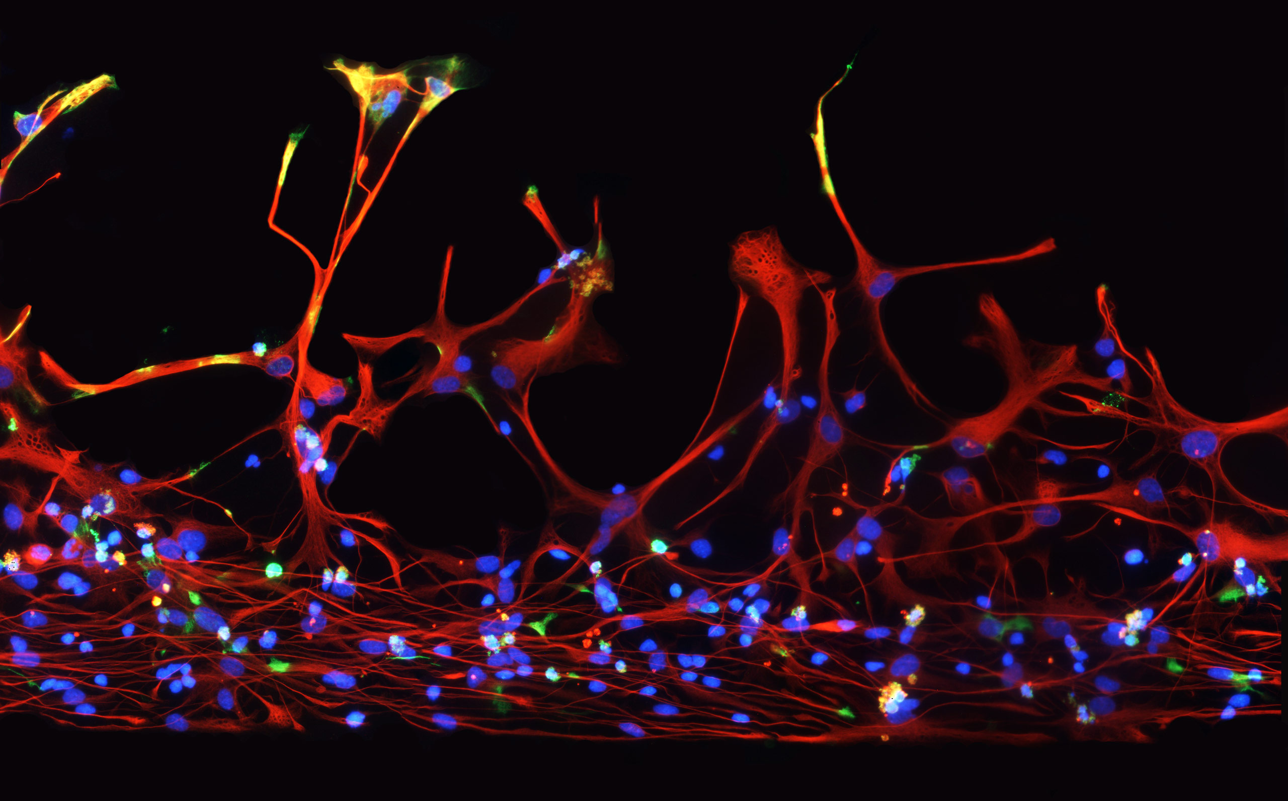 Human neural stem cells | Nikon Small World