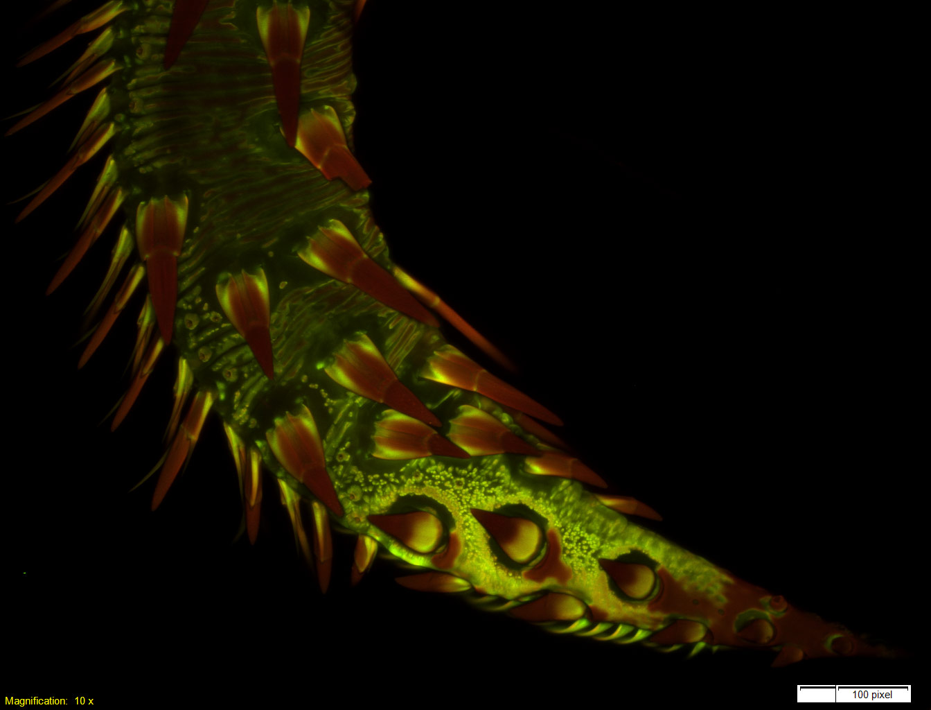 Proboscis tip of a vampire moth | Nikon Small World