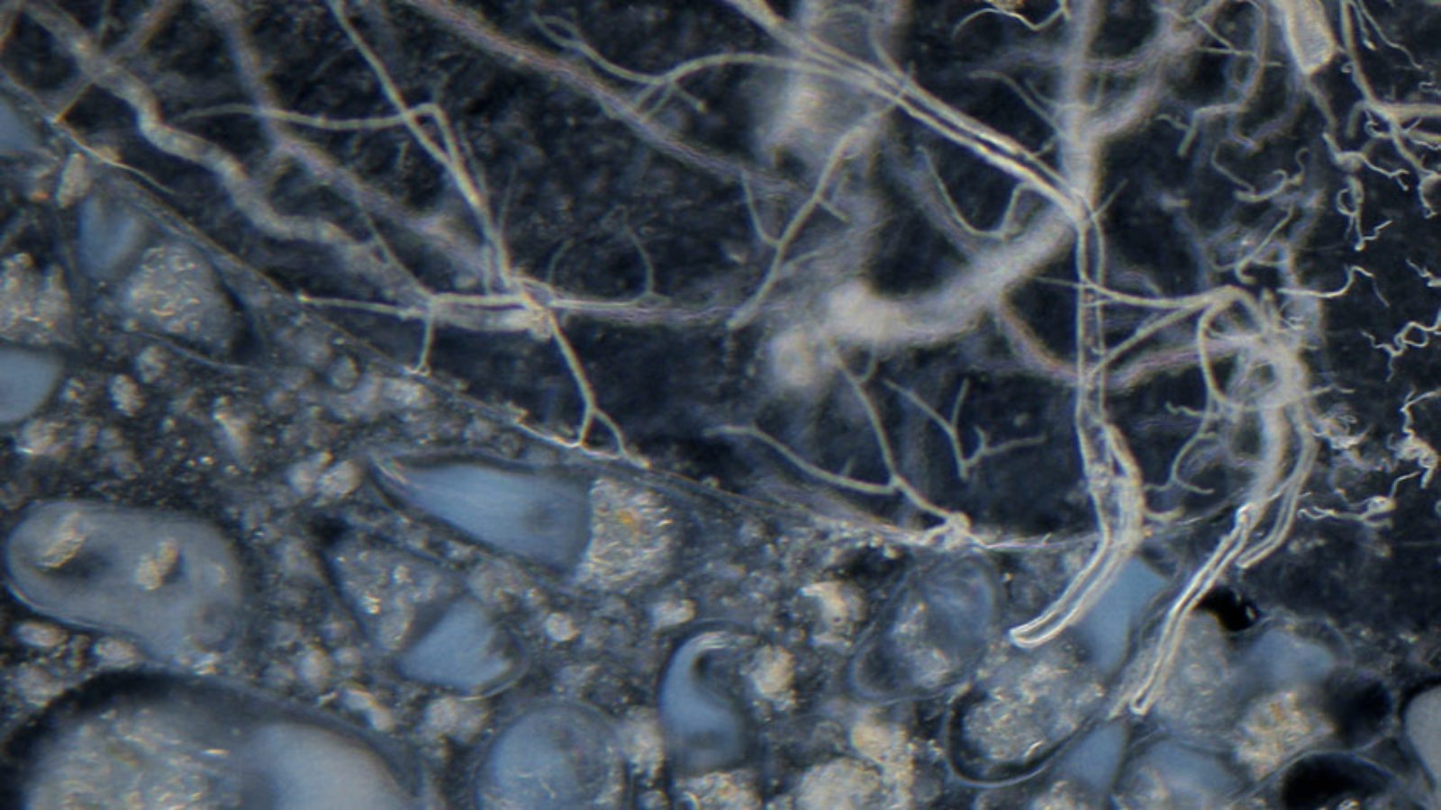 Gut contents of a termite, containing hundreds of species of single ...