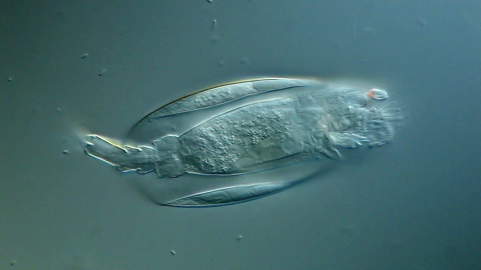 Rotifer (Lepadella triba) feeding | Nikon Small World
