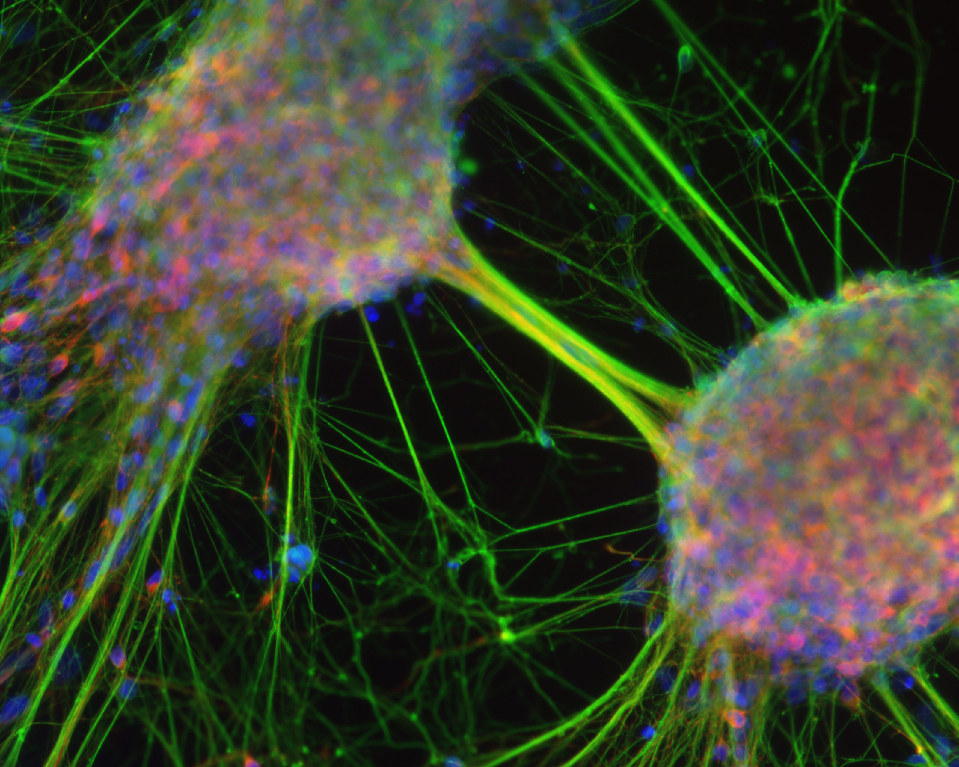 Micrometamorphosis: from human stem cells to neurons | Nikon Small World