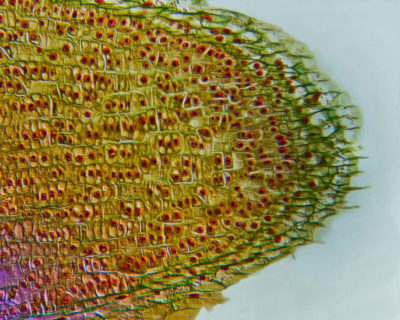 Root tip section of a dicot plant | Nikon Small World