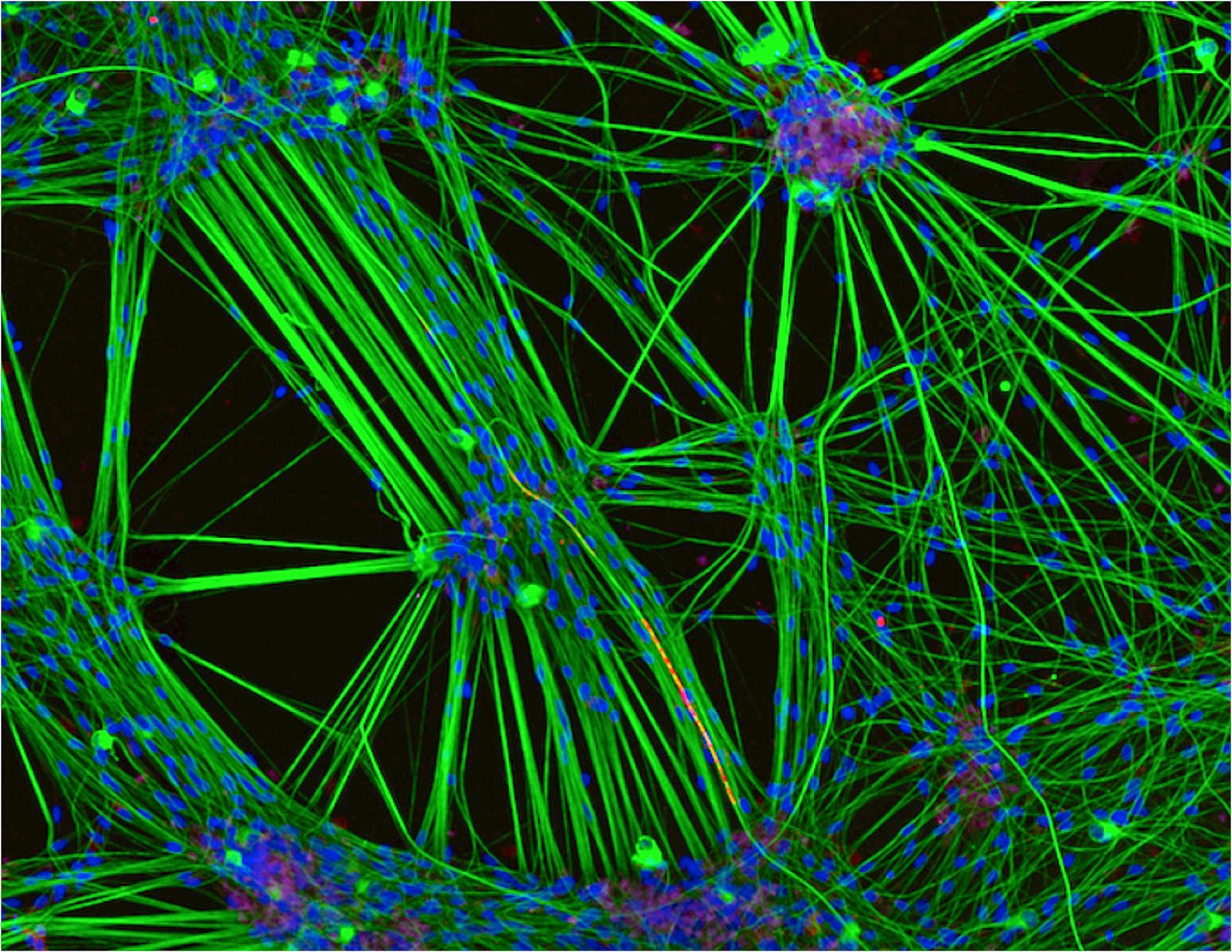 Culture of neurons derived from human skin cells and Schwann cells ...