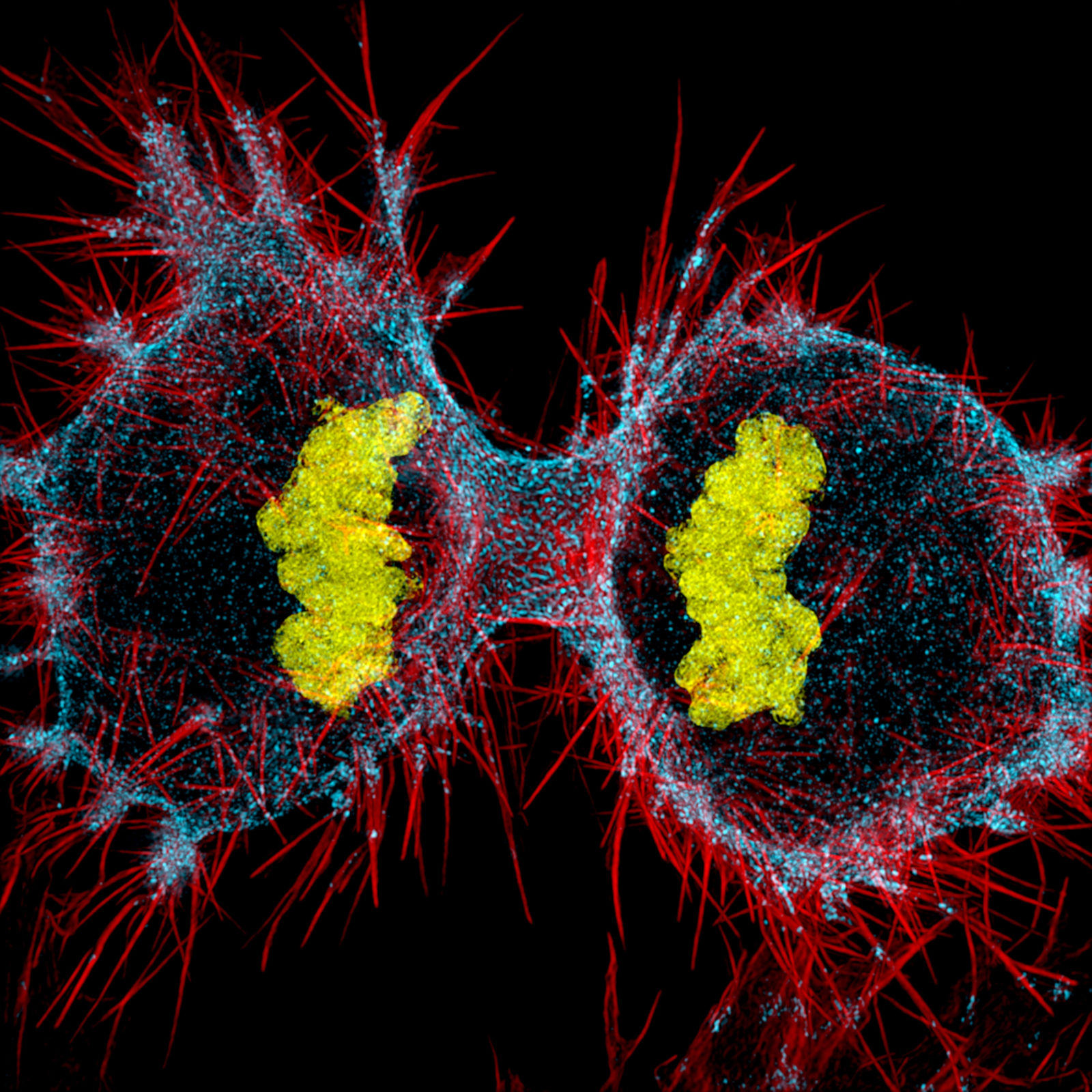 Human HeLa cell undergoing cell division | Nikon Small World