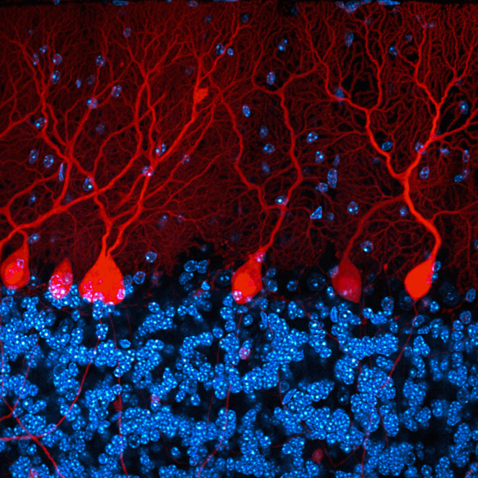 Section of the cerebellum stained for Purkinje cells and nuclei | Nikon ...