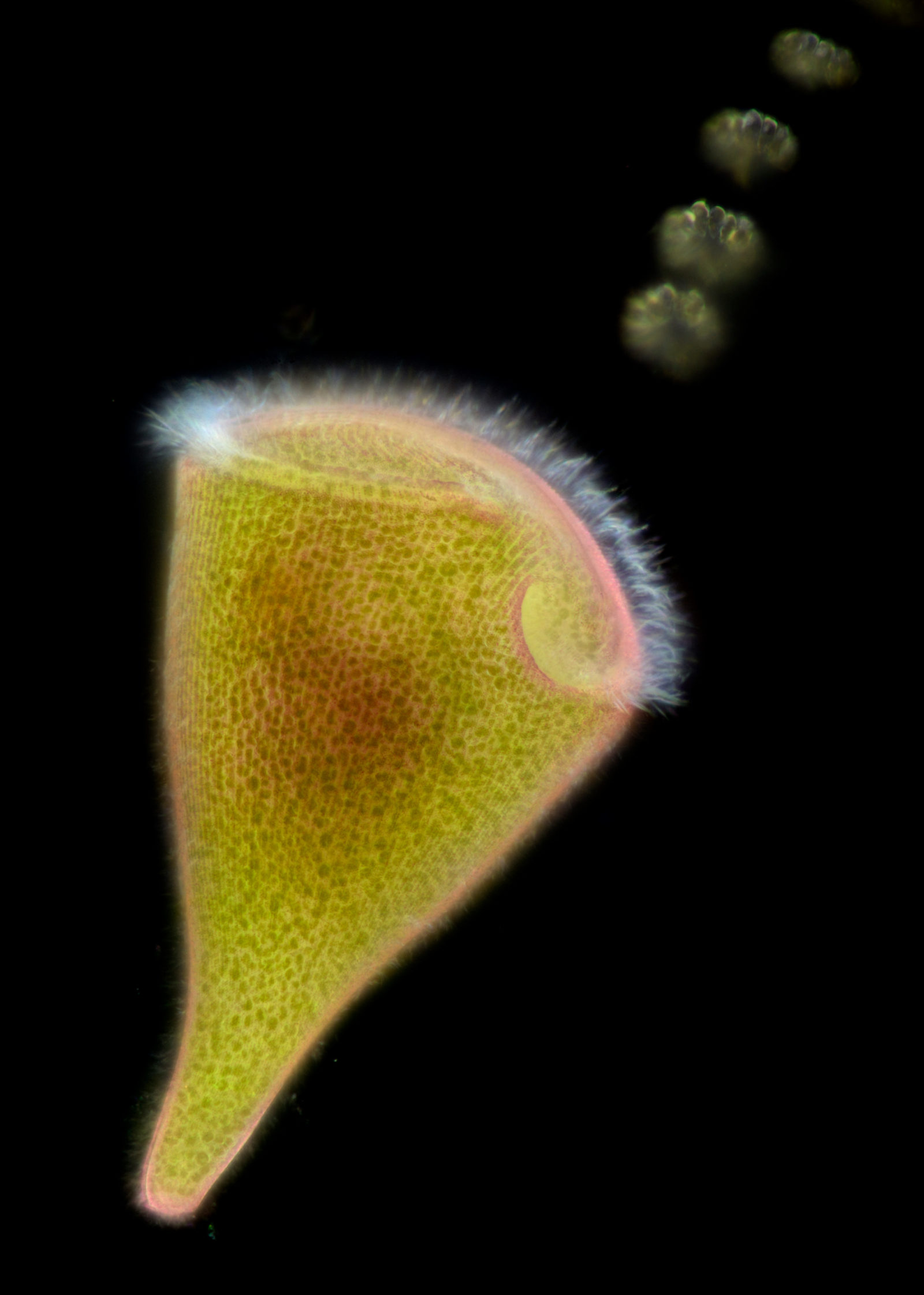Trumpet animalcule containing endosymbionts | Nikon Small World