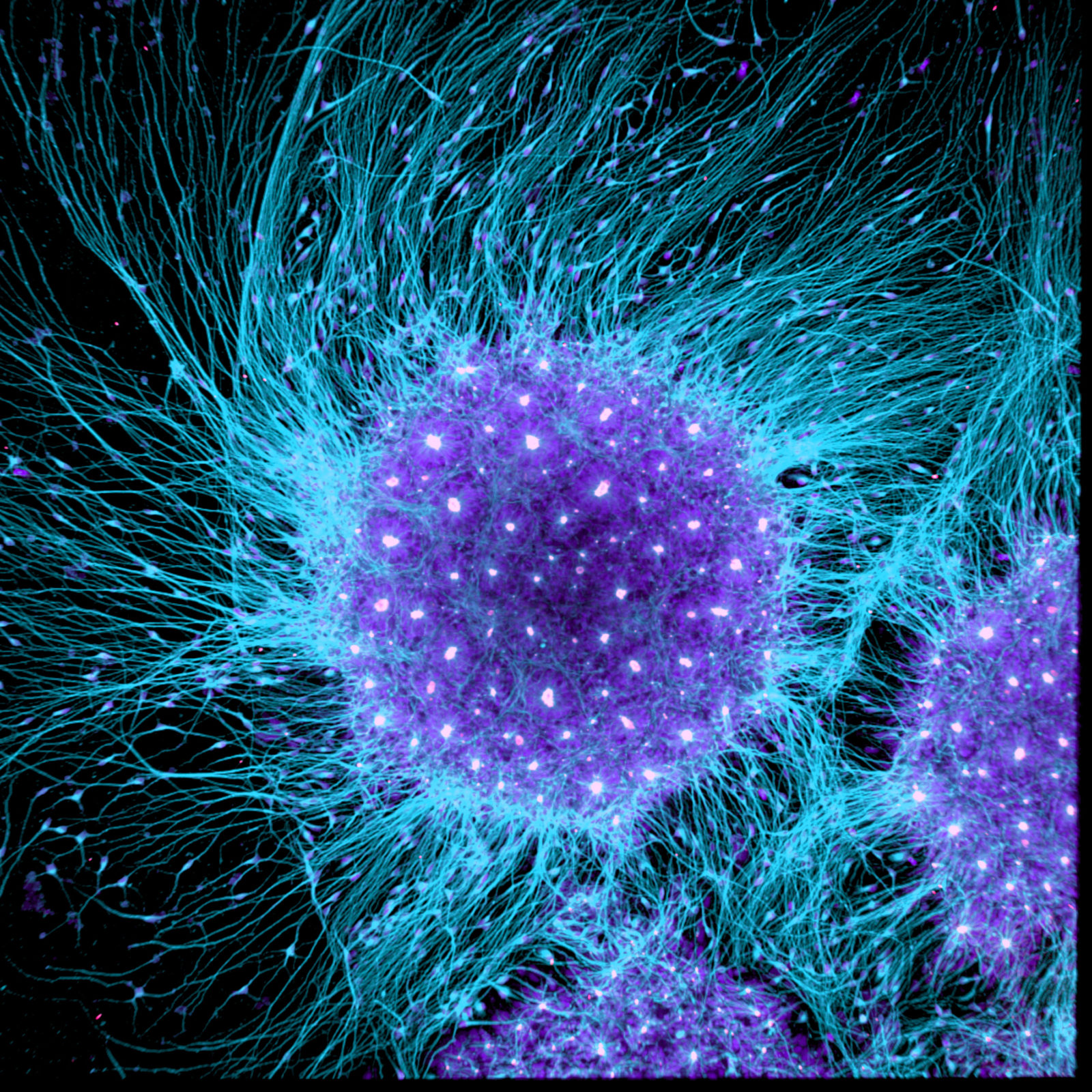 Human neural rosette primordial brain cells | Nikon Small World