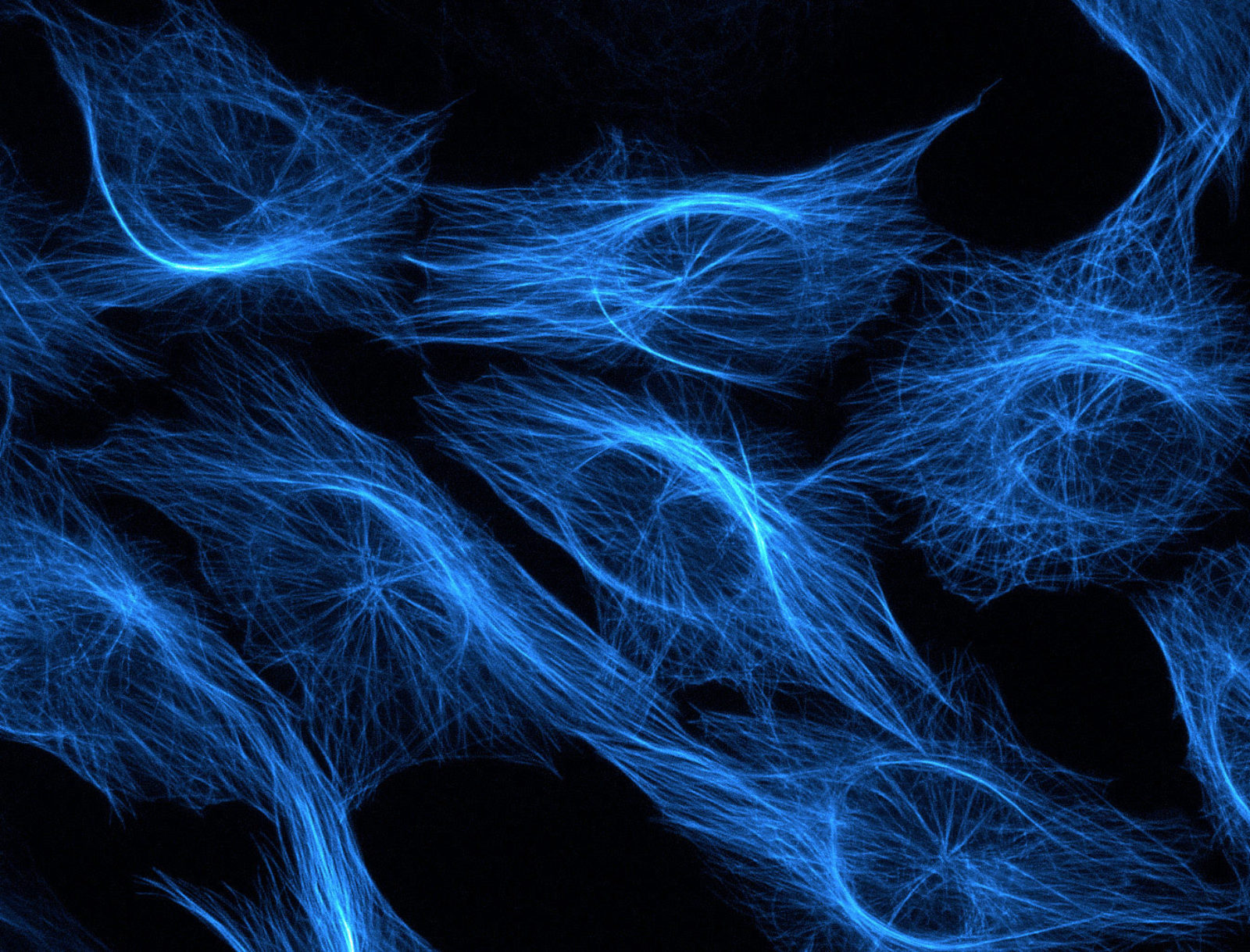 HaCaT cells expressing a fluorescent microtubule marker | Nikon Small World