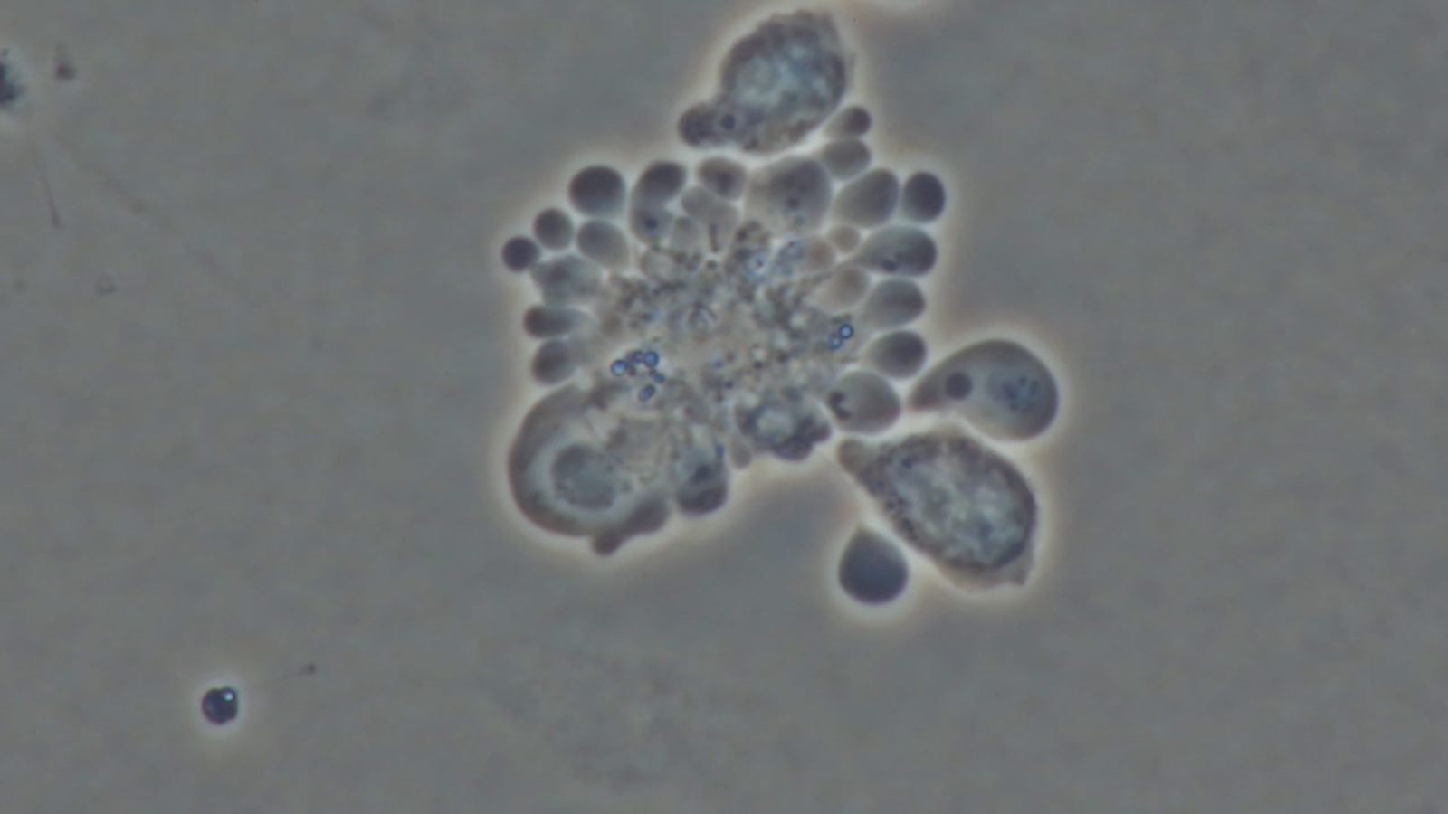 In vitro visualization of natural killer cells attacking cancer cell | Nikon Small World