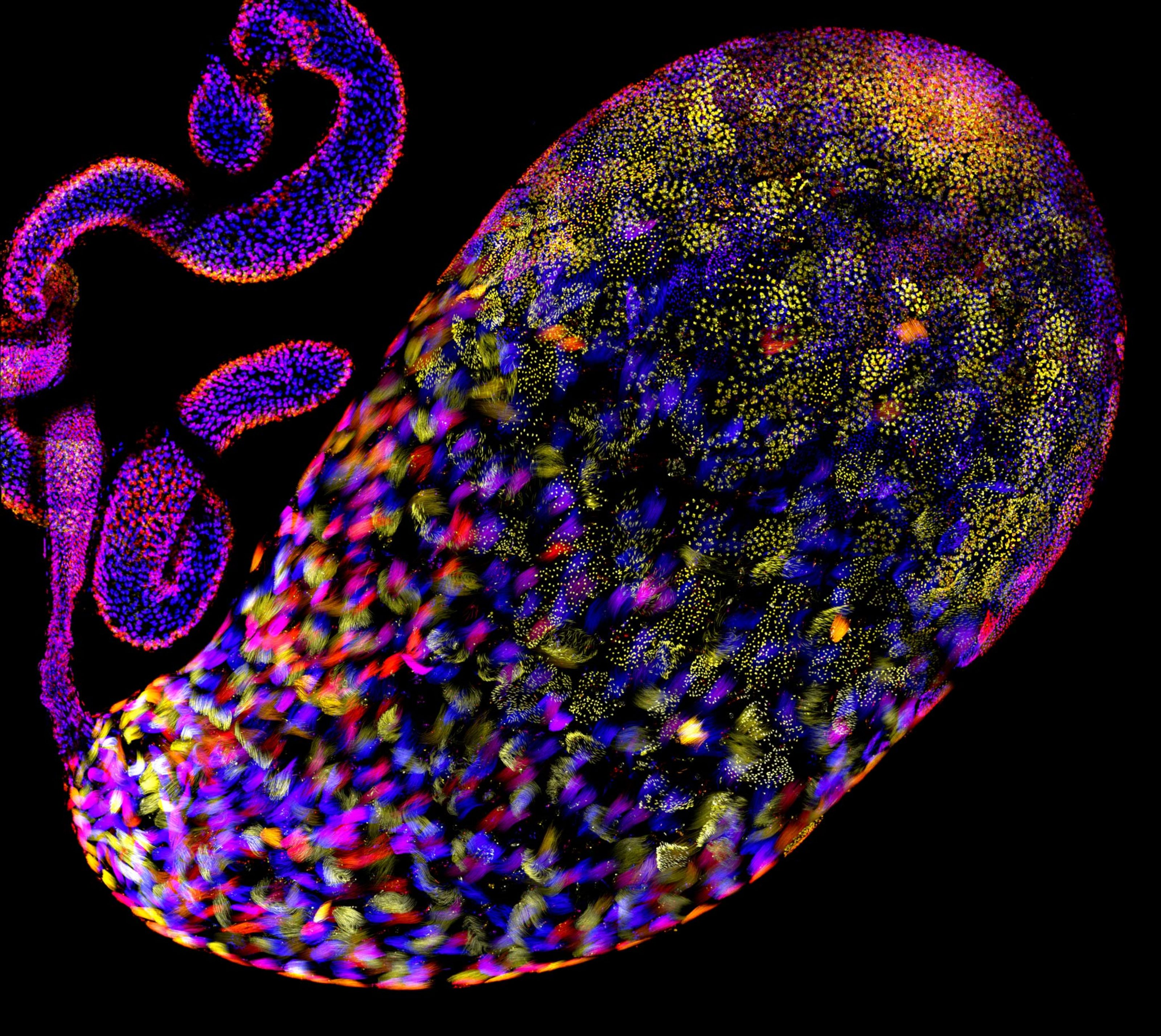 Testis of a fruit fly (Drosophila pseudoobscura) | Nikon Small World