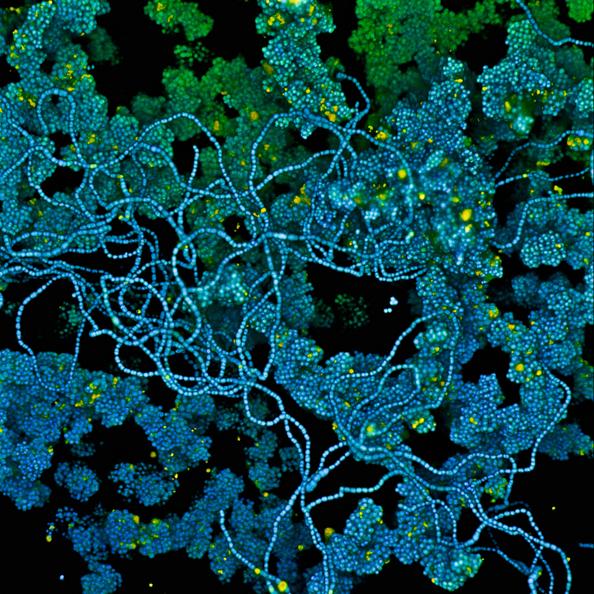 Long chains of S. pyogenes infecting grape-like clusters of MRSA ...