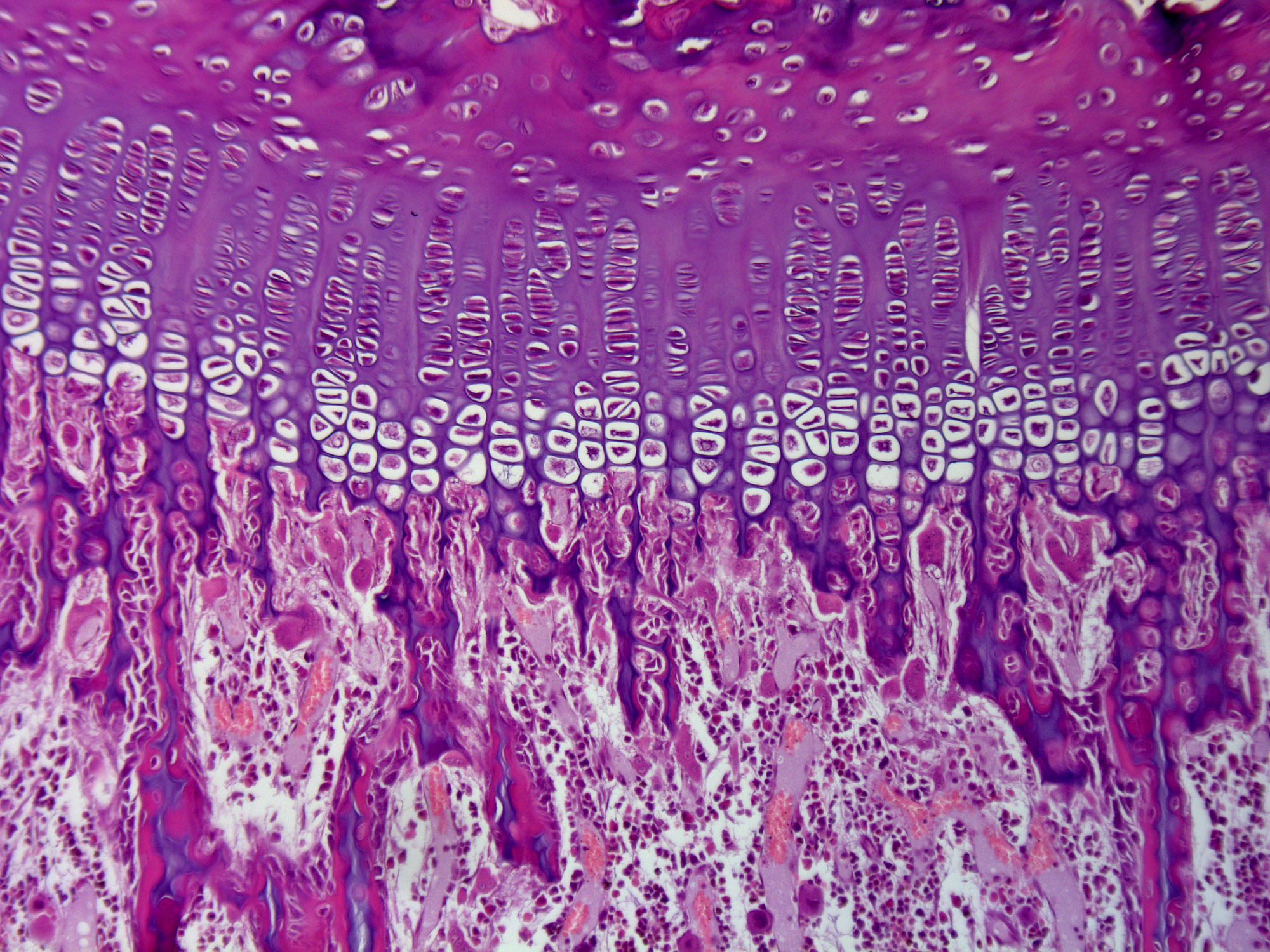 Section of long bone | Nikon Small World