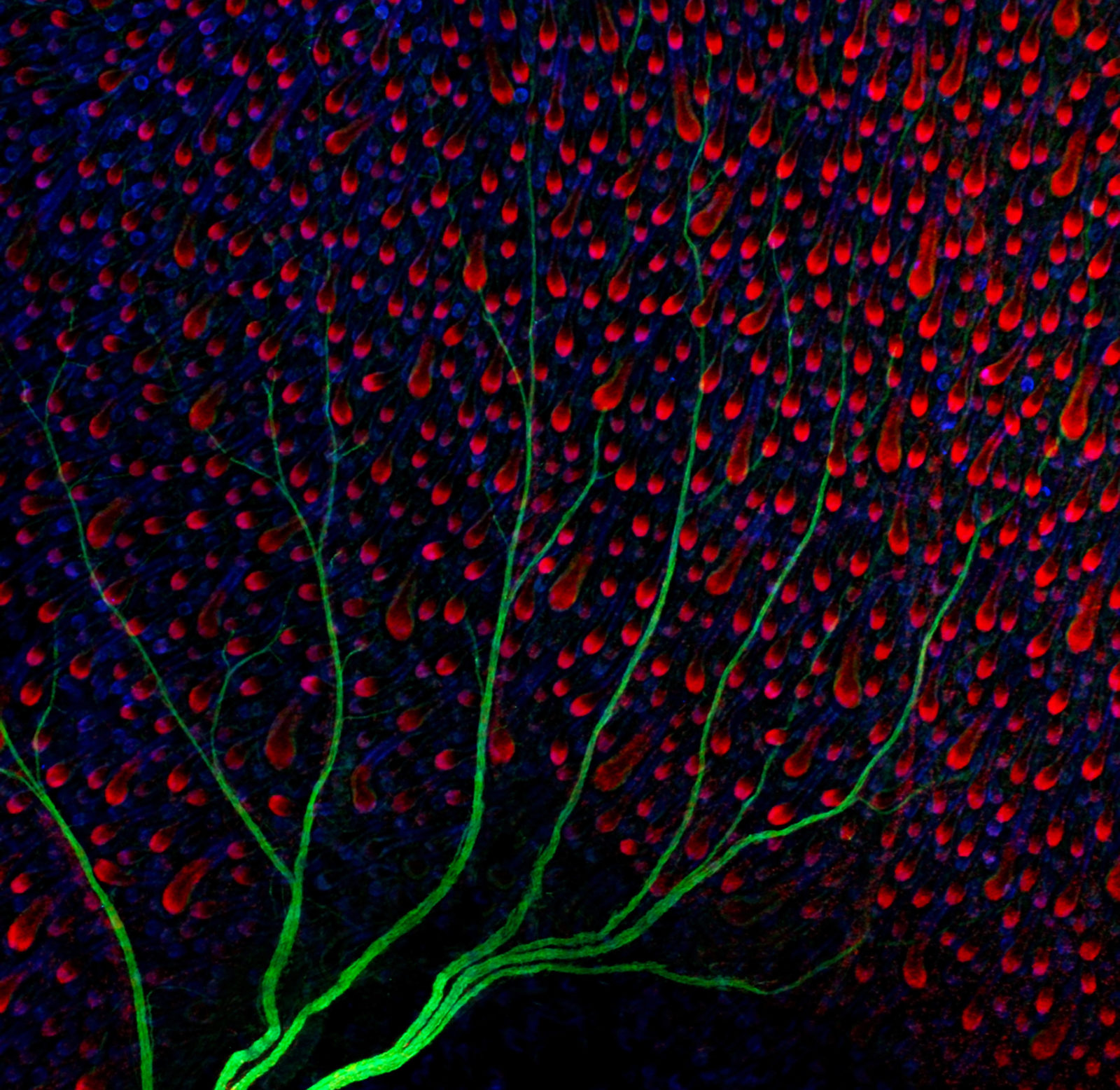 Nerves (in green) under the skin of a mouse (hair follicles are shown ...