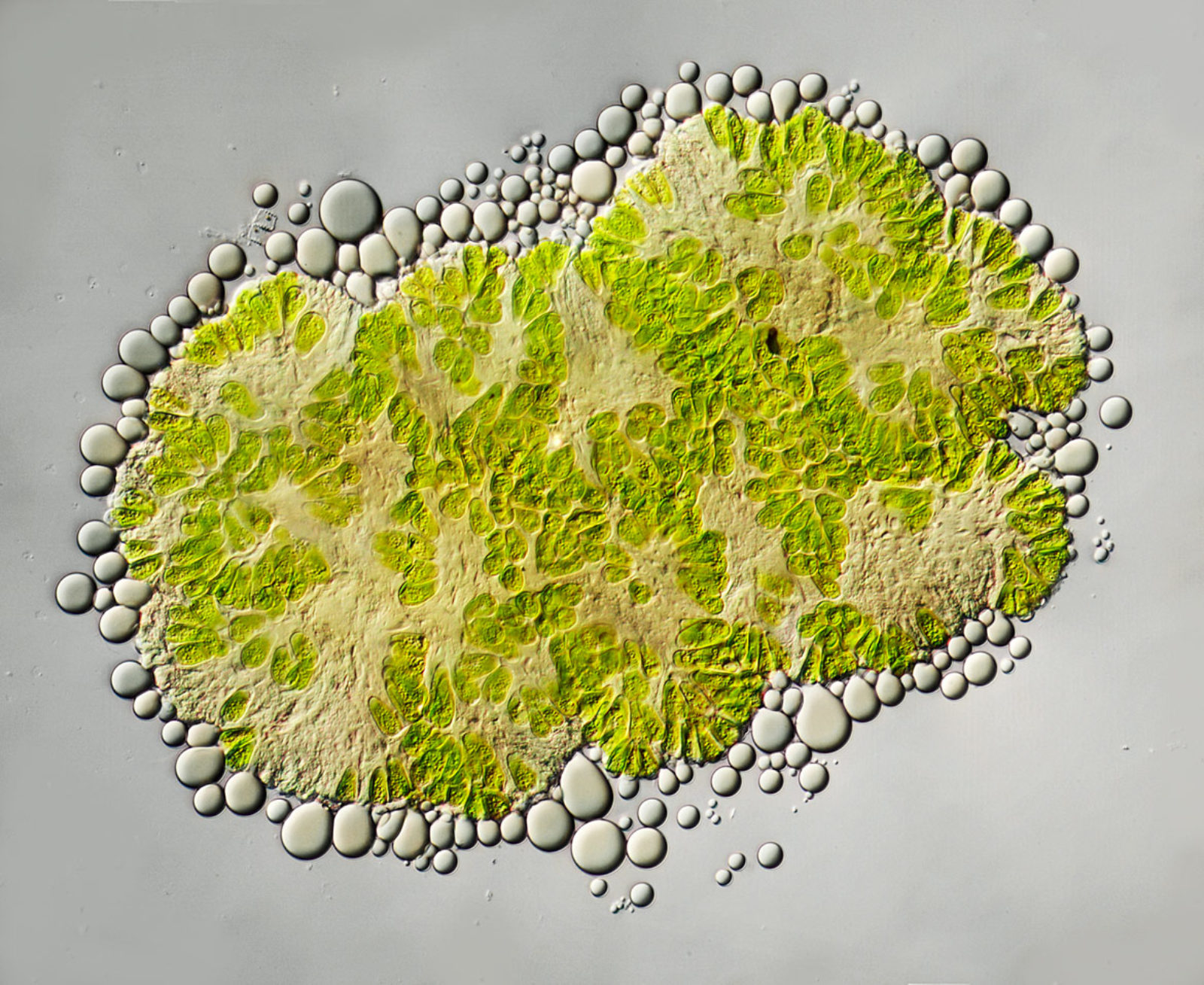 Botryococcus sp. (freshwater plankton) | Nikon Small World