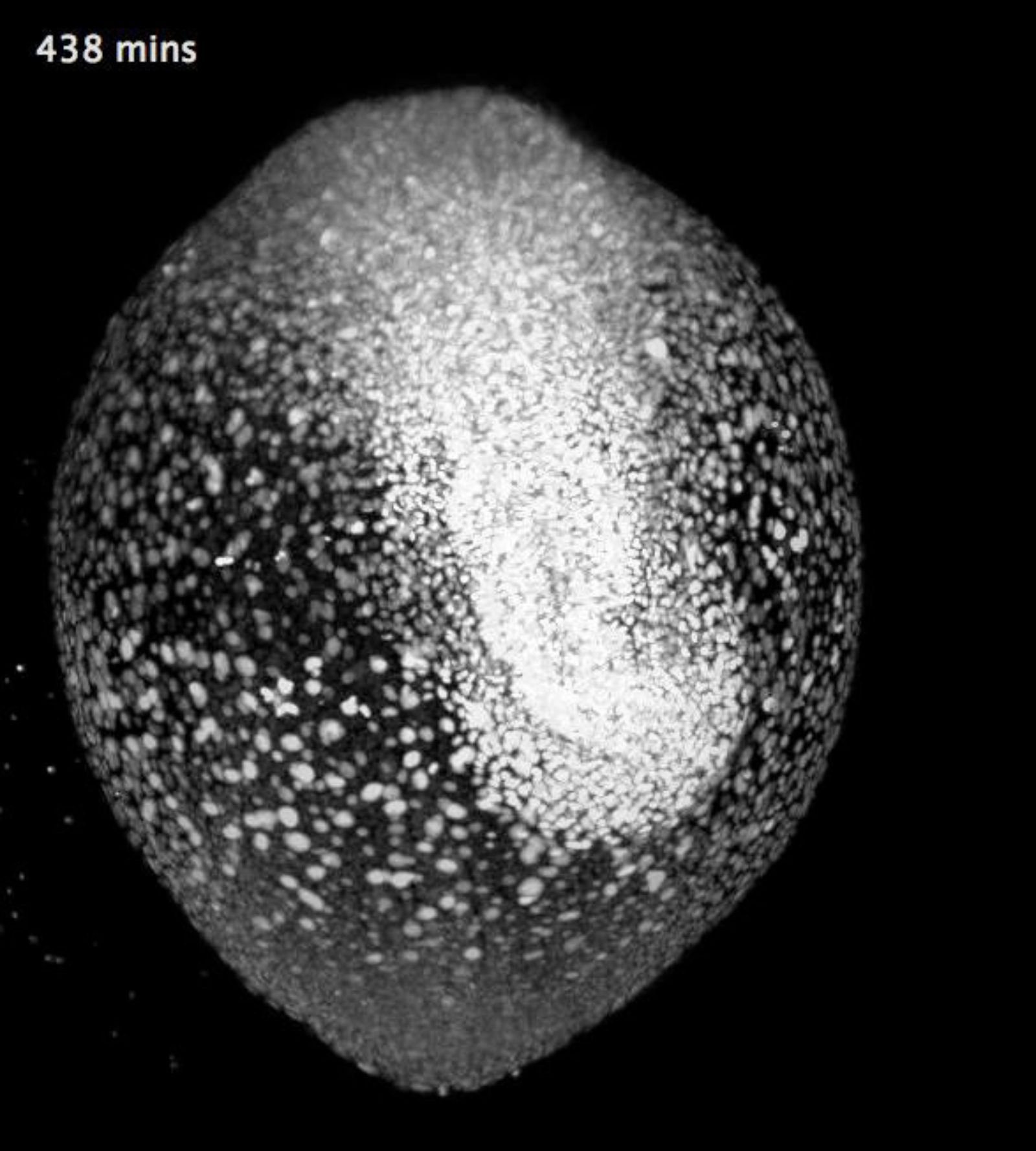 Zebrafish embryo development | Nikon Small World