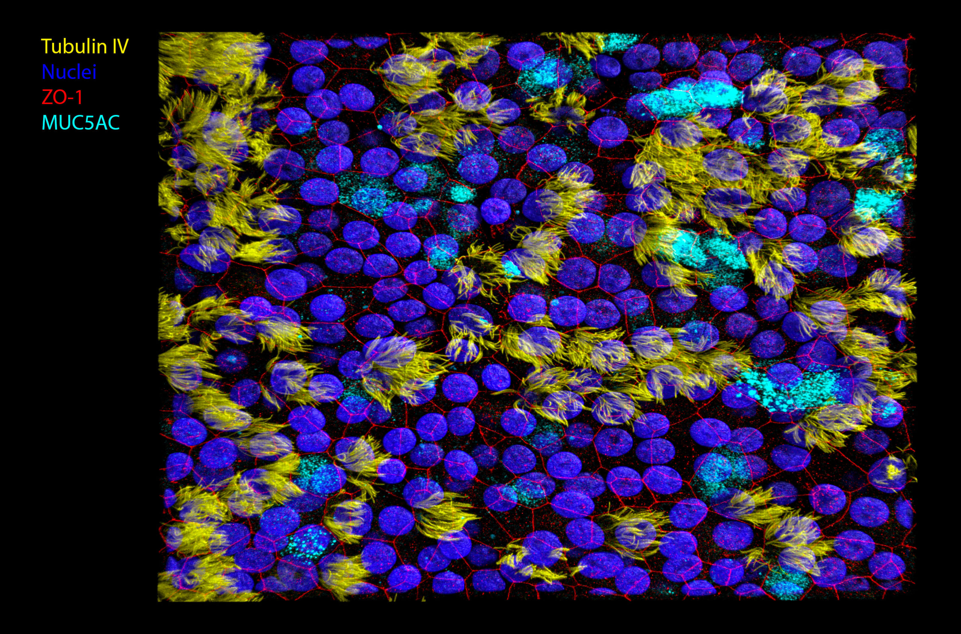 Ciliated respiratory epithelial cells | Nikon Small World