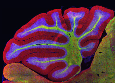 Sagittal section of mouse cerebellum (brain) | Nikon Small World