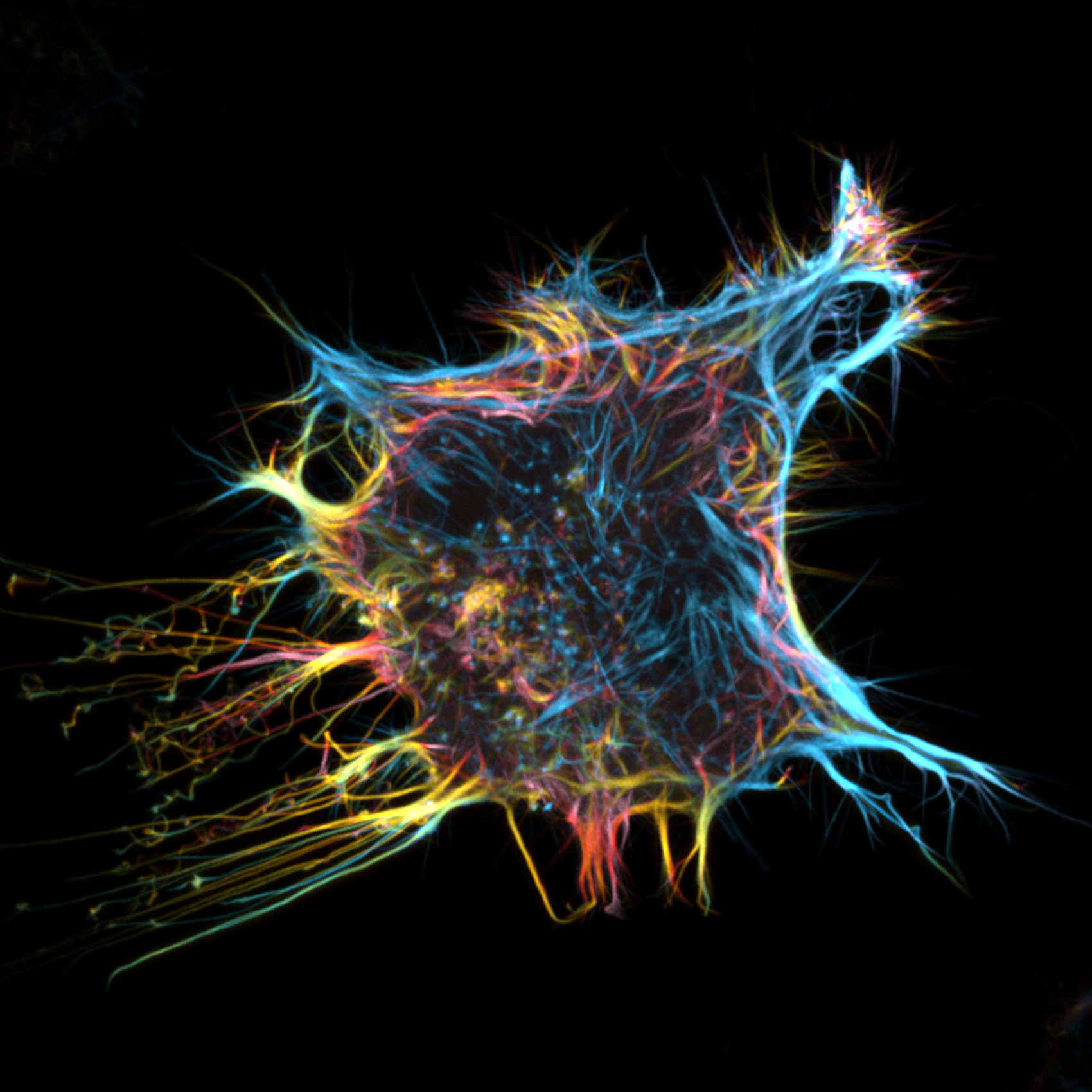 Fluorescent actin protein in a living HeLa cell | Nikon Small World