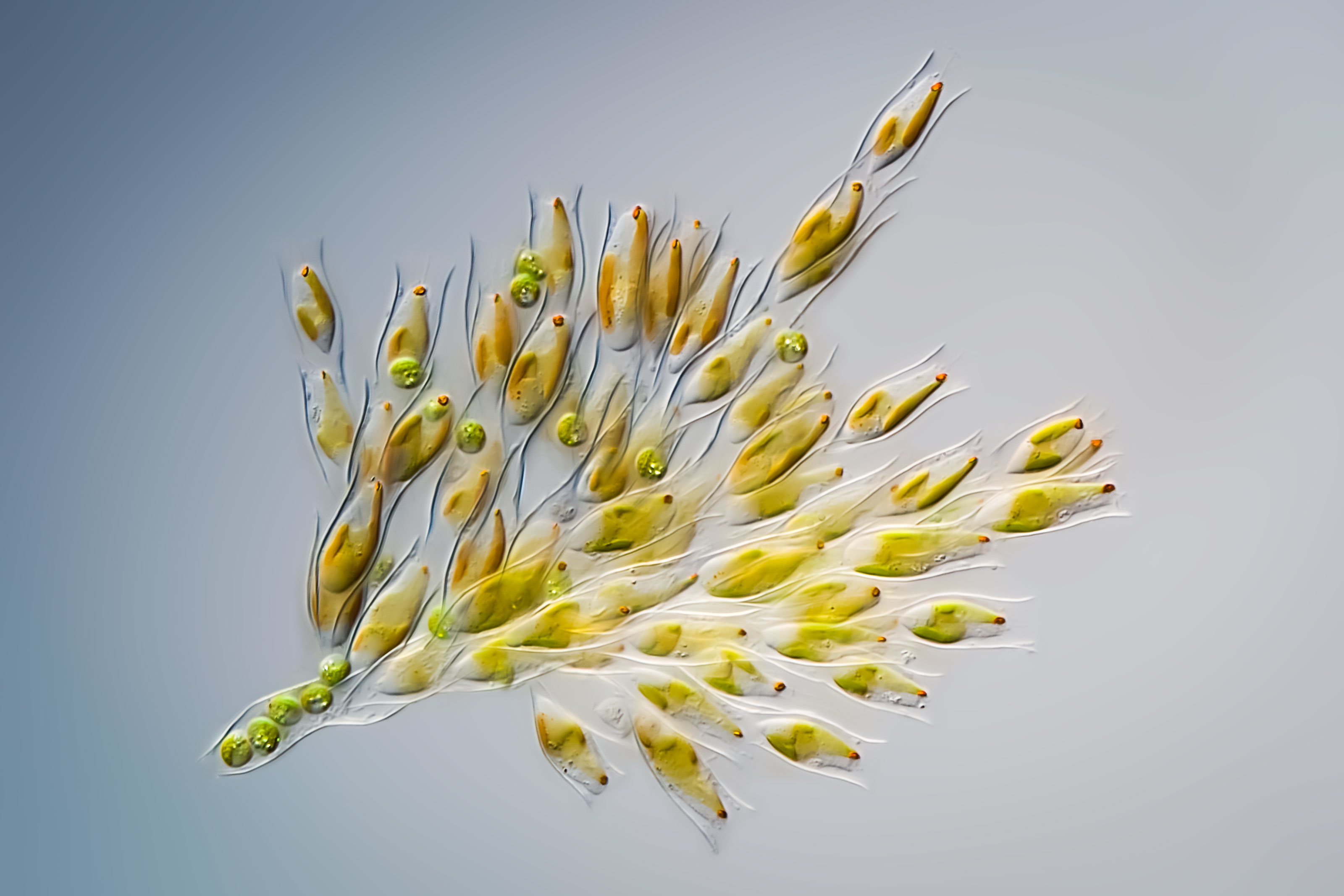 Dinobryon - Golden Algae (a colonial freshwater algae) | Nikon Small World