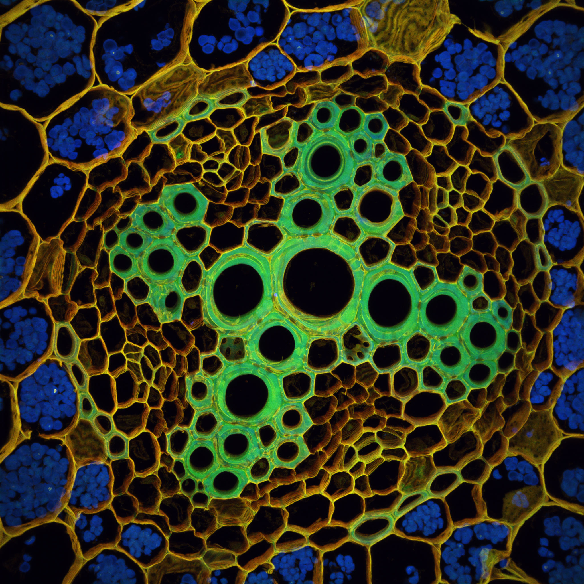 Ranunculus (buttercup) root xylem and phloem | Nikon Small World