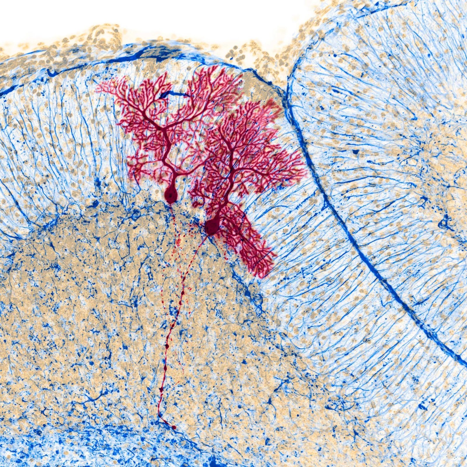 Dye-injected Purkinje cells in mouse cerebellum | Nikon Small World