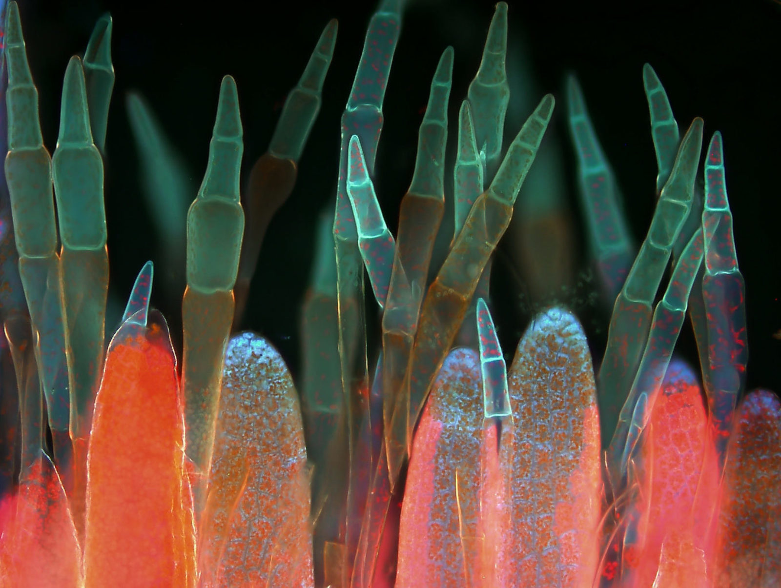 Bryum hornum (moss) antheridia (sex organ) and paraphyses (support ...