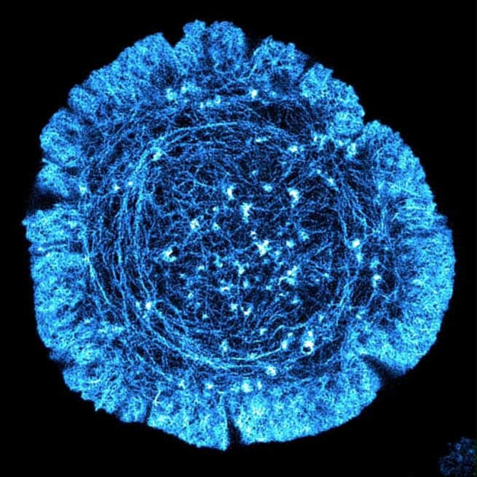 The dynamics of the actin cell skeleton in a mouse B lymphocyte after ...