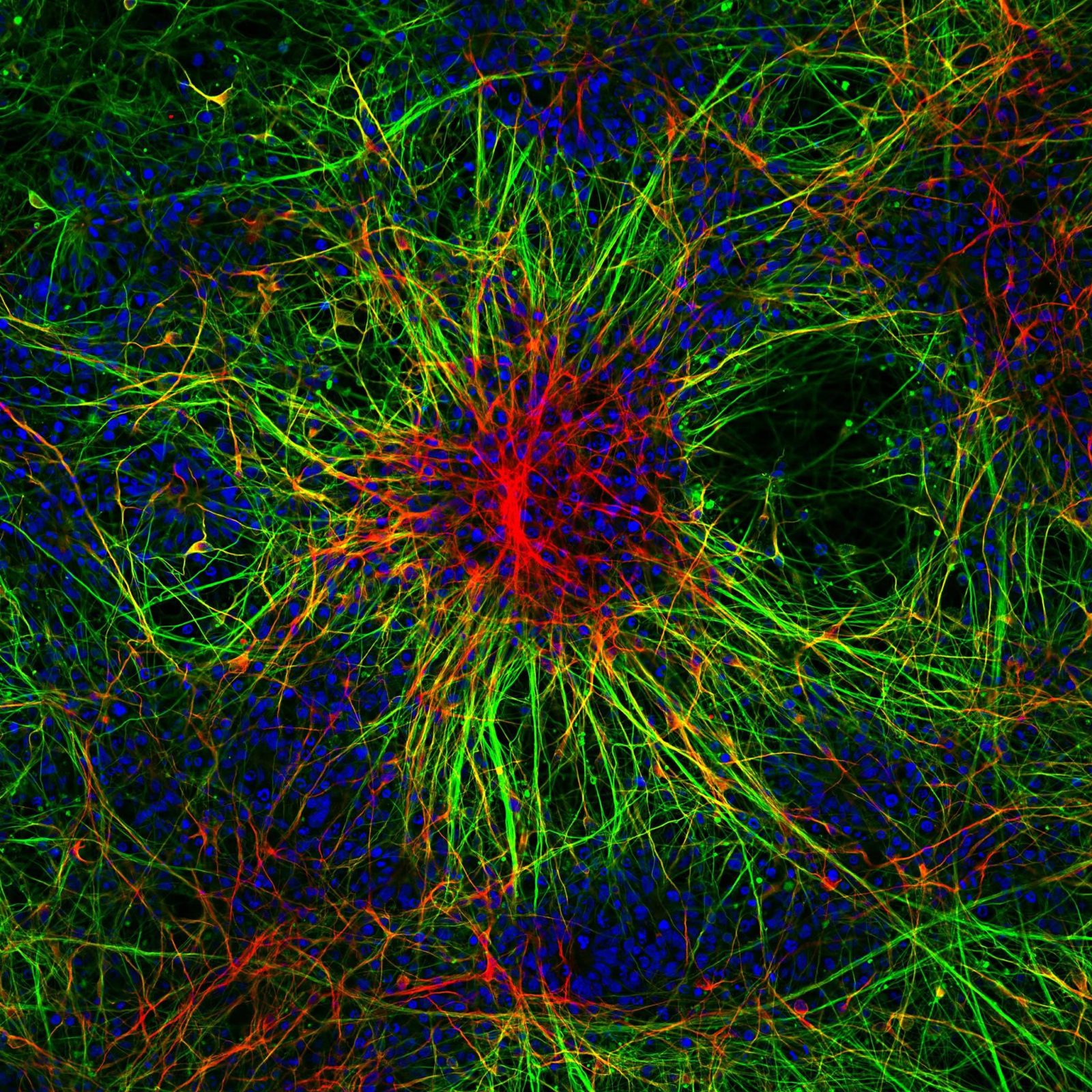 Human skin cells reprogrammed and differentiated into neurons | Nikon ...