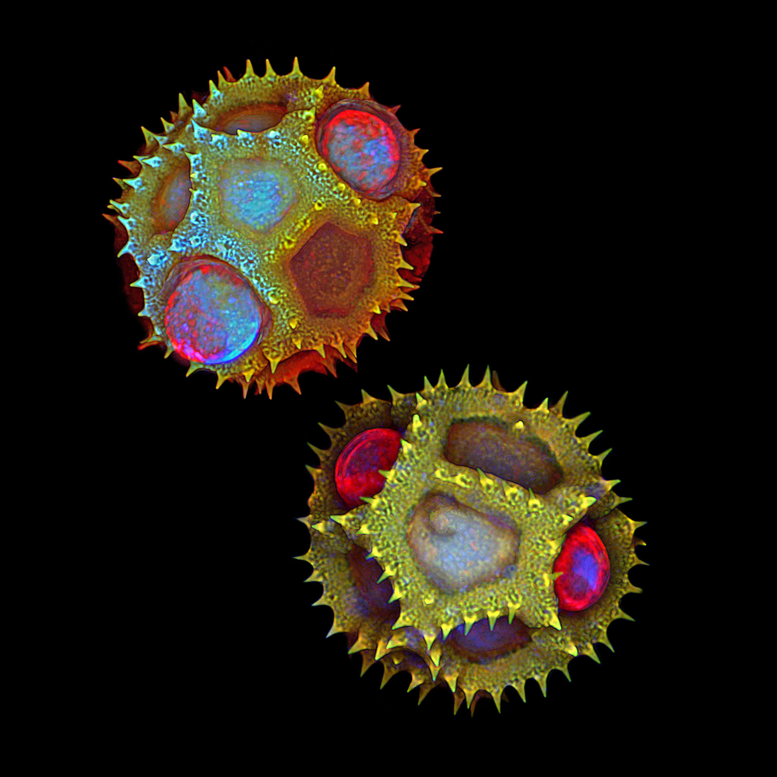 Dandelion pollen | Nikon Small World