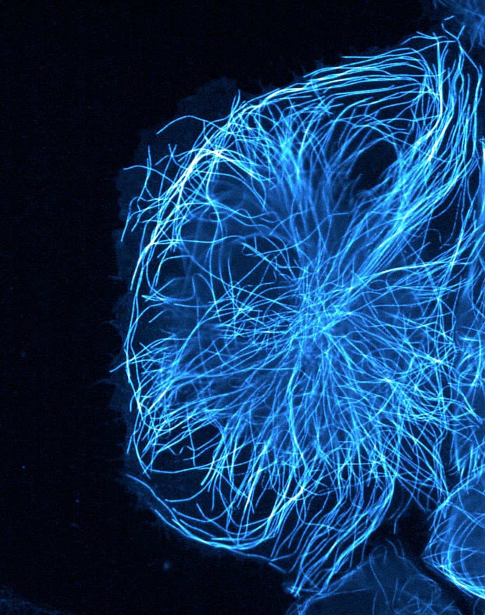 Labeling of the microtubule cytoskeleton in a human cell line | Nikon ...