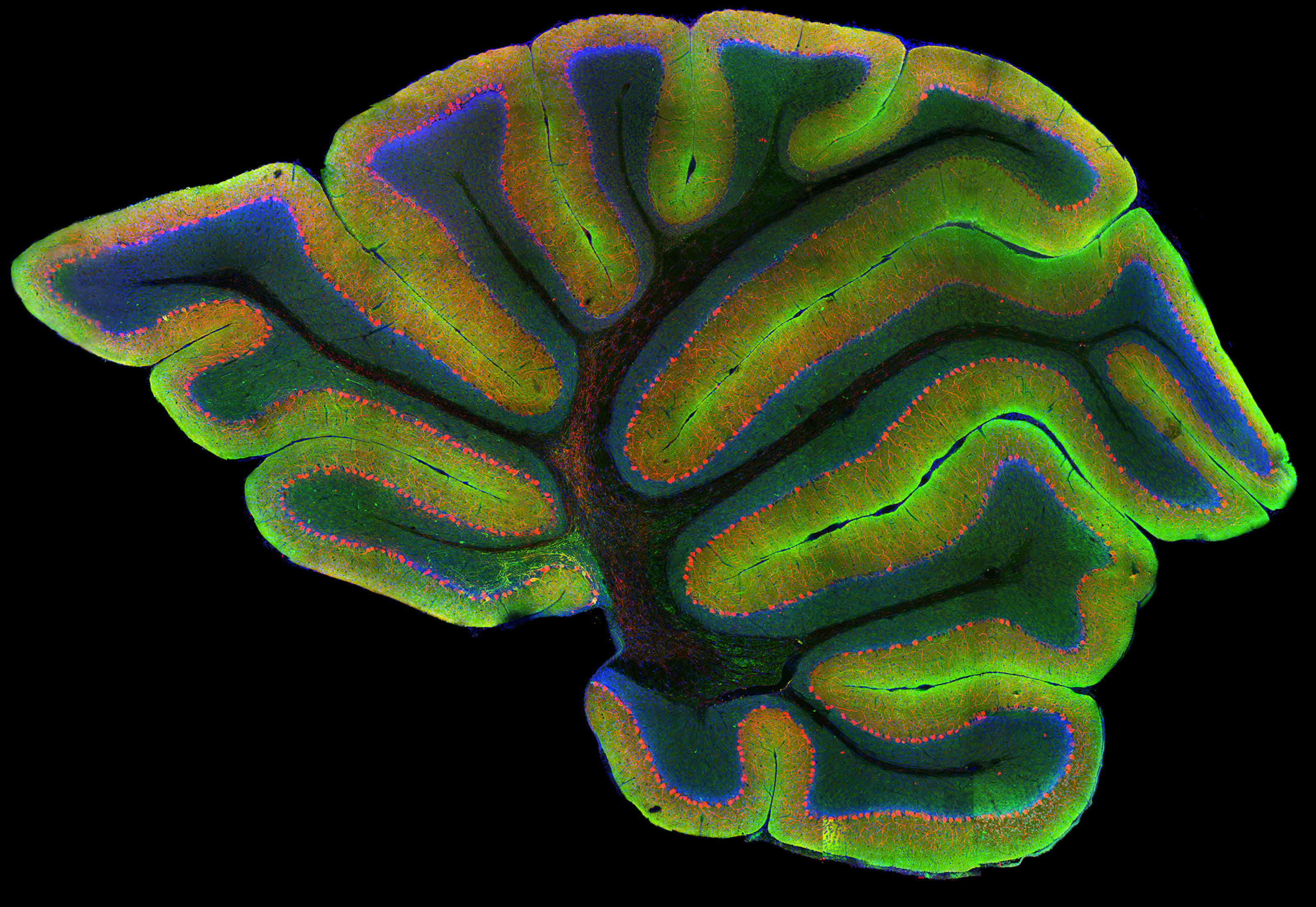 Cerebellum showing Purkinje cells (red), nuclei (blue) and tau (green ...