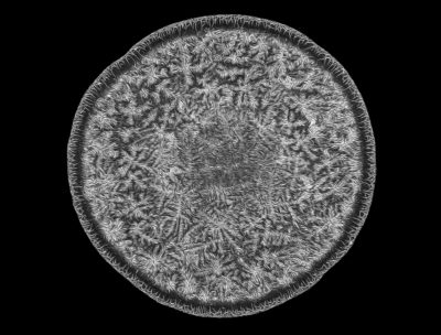 Human tear drop | Nikon Small World