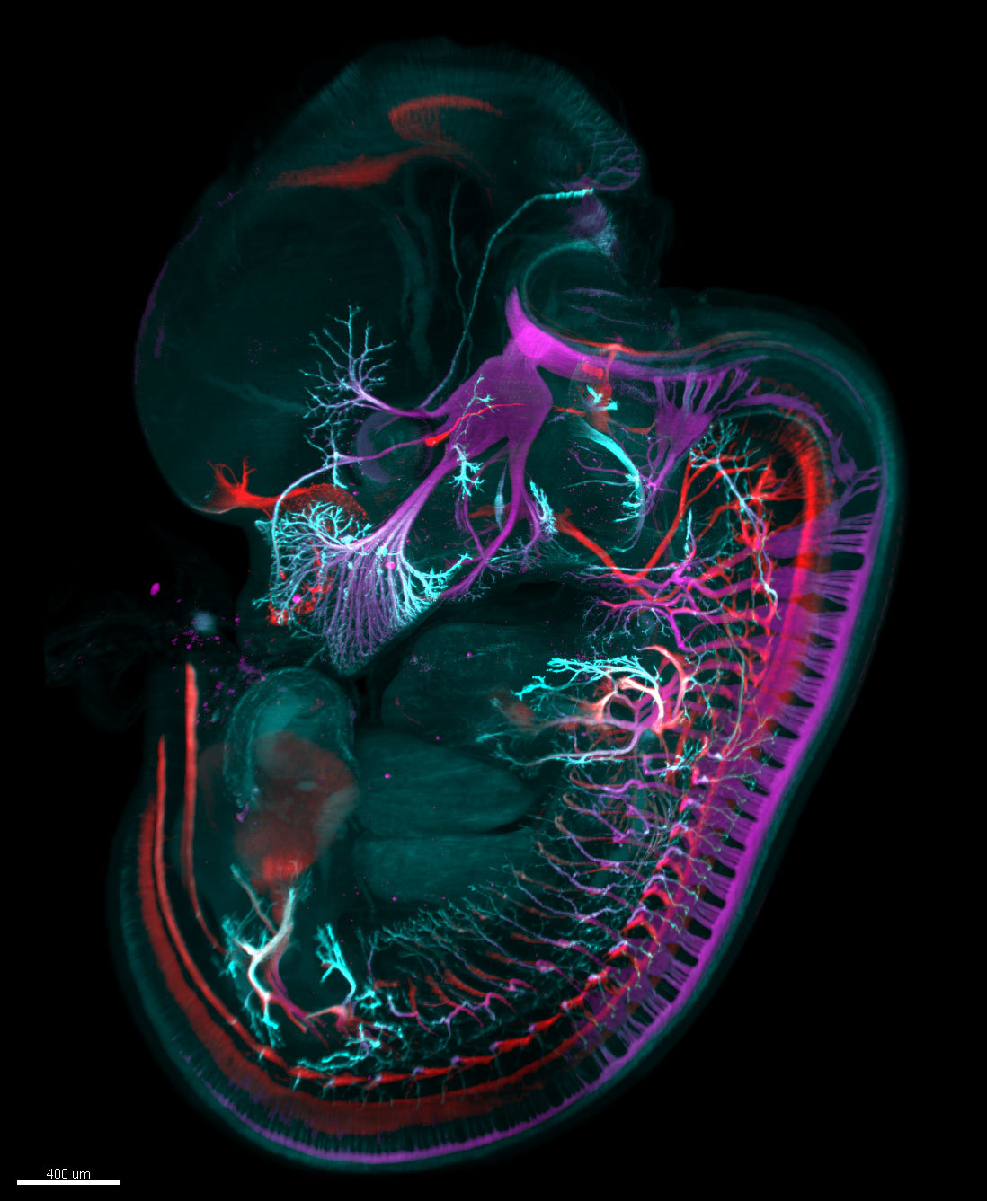 Mouse embryo (day 12.5) stained for motor (red) and sensory (magenta ...