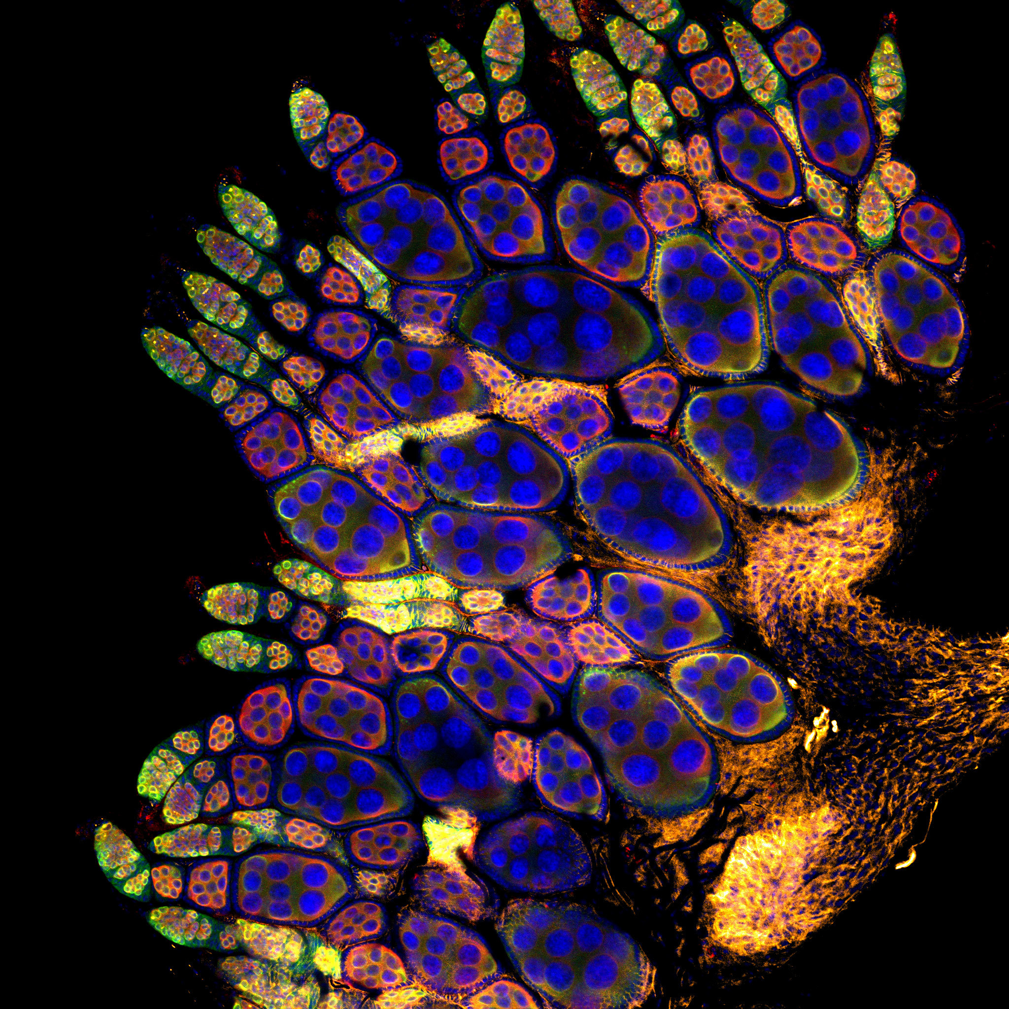 Fruit fly ovary from a young adult | Nikon Small World