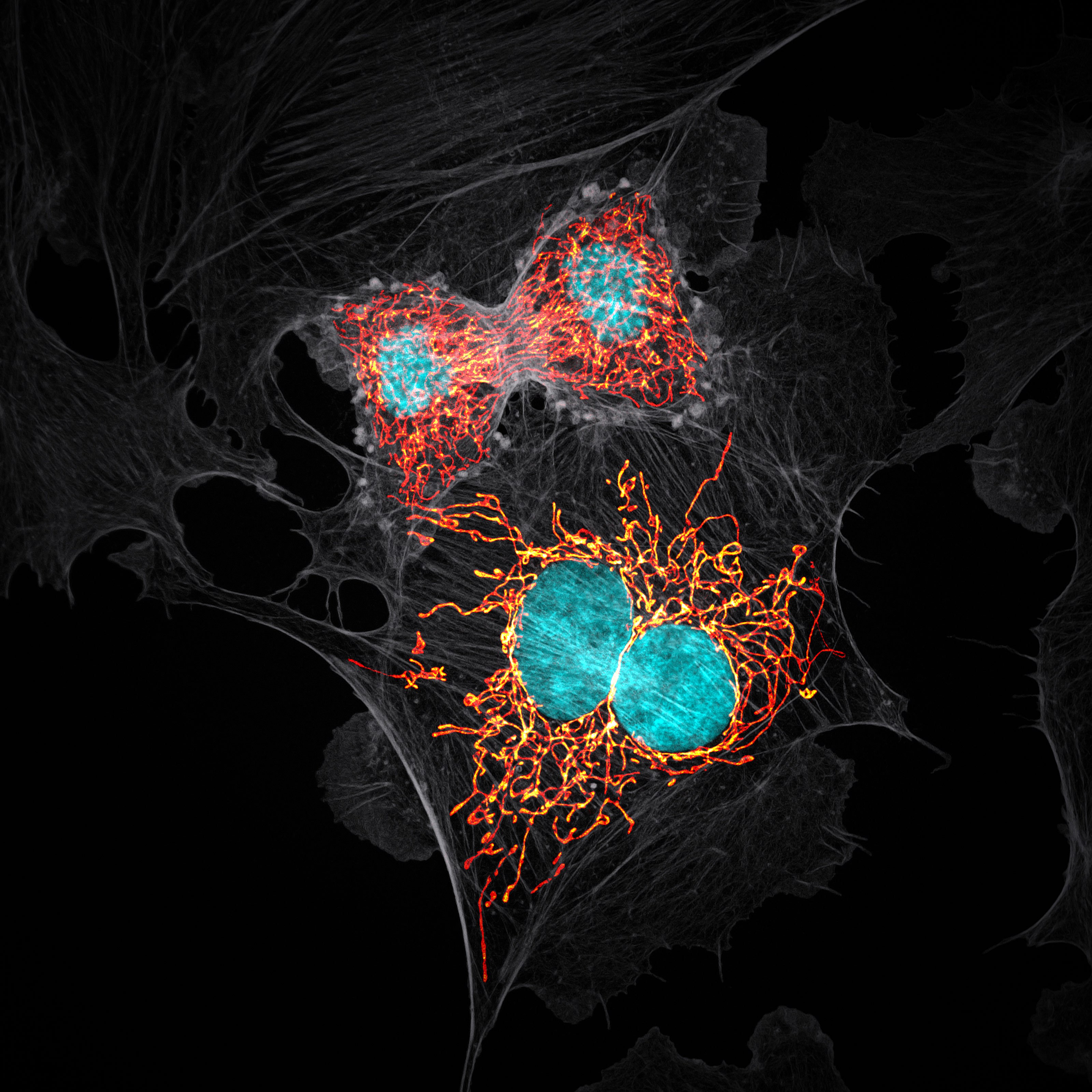 BPAE cells in telophase stage of mitosis | Nikon Small World