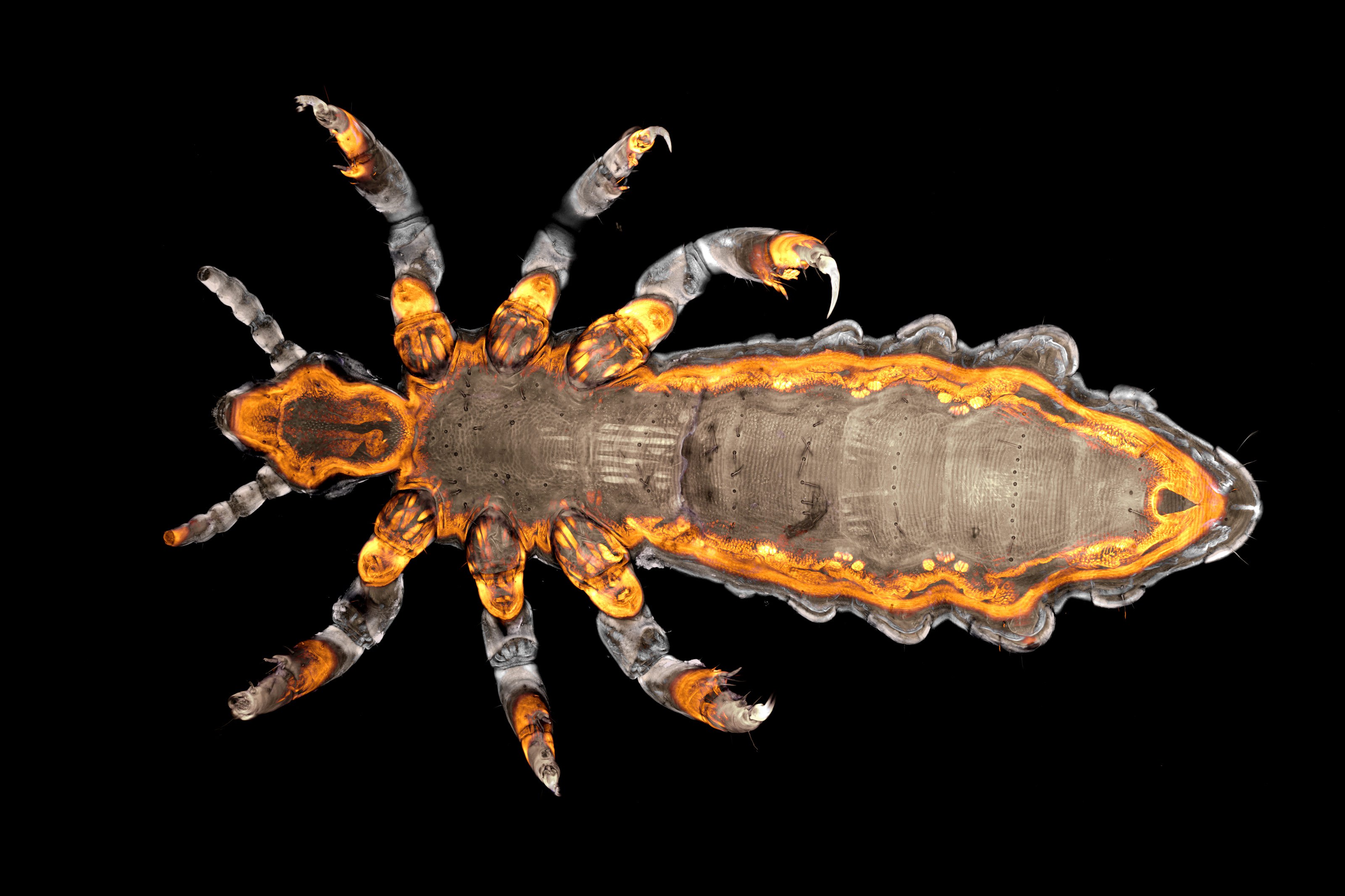 Pediculus humanus capitis (human head louse) | Nikon Small World