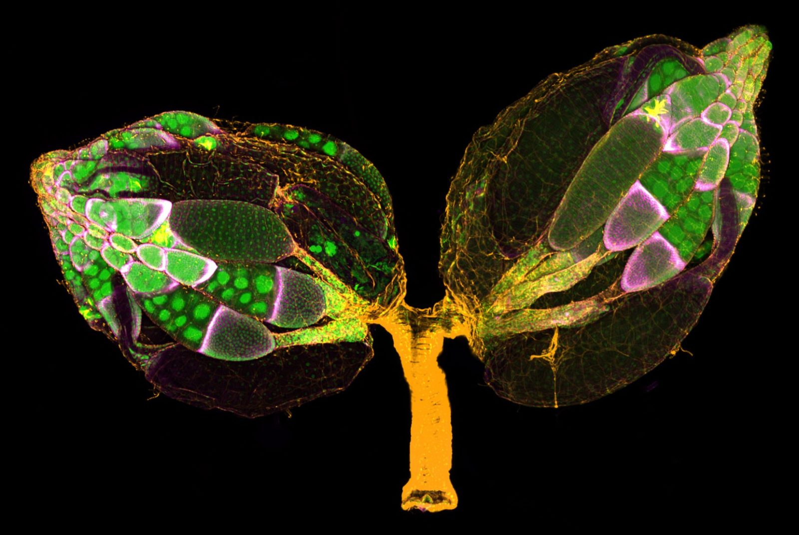 A pair of ovaries from an adult Drosophila female | Nikon Small World