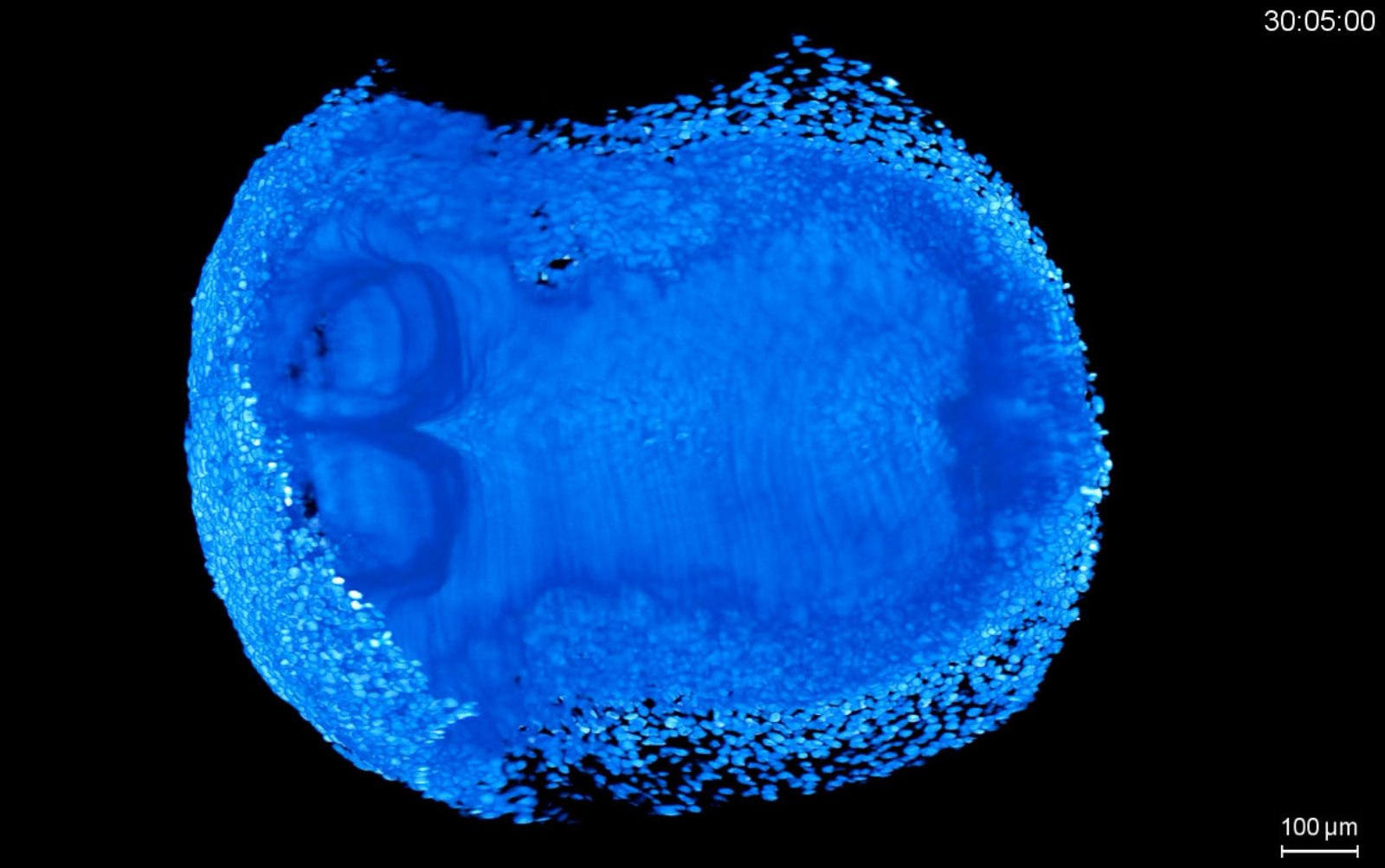 Developing mouse embryo, showing the progression of neural tube folding ...