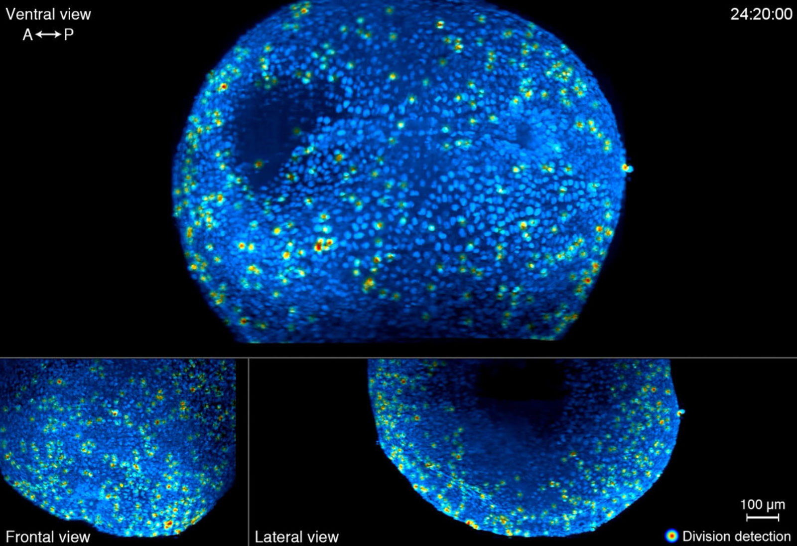 Auto-detection of dividing cells in an entire developing mouse embryo ...