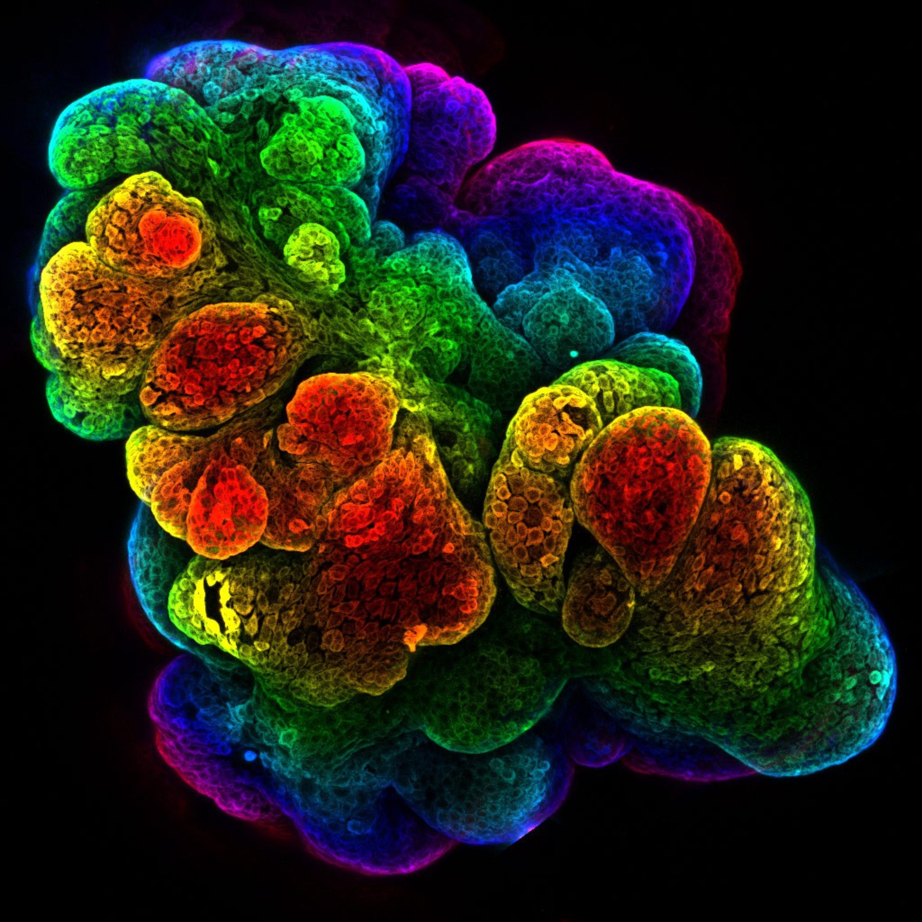Lab-grown mouse mammary gland organoid | Nikon Small World