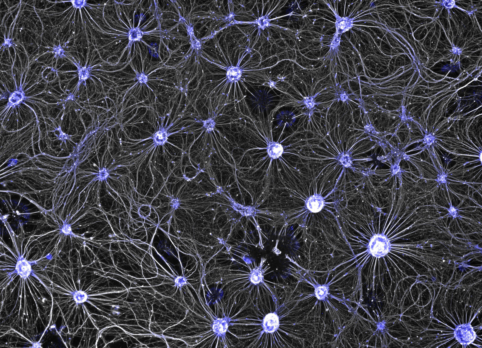 Motor neurons derived from human induced pluripotent stem cells | Nikon ...
