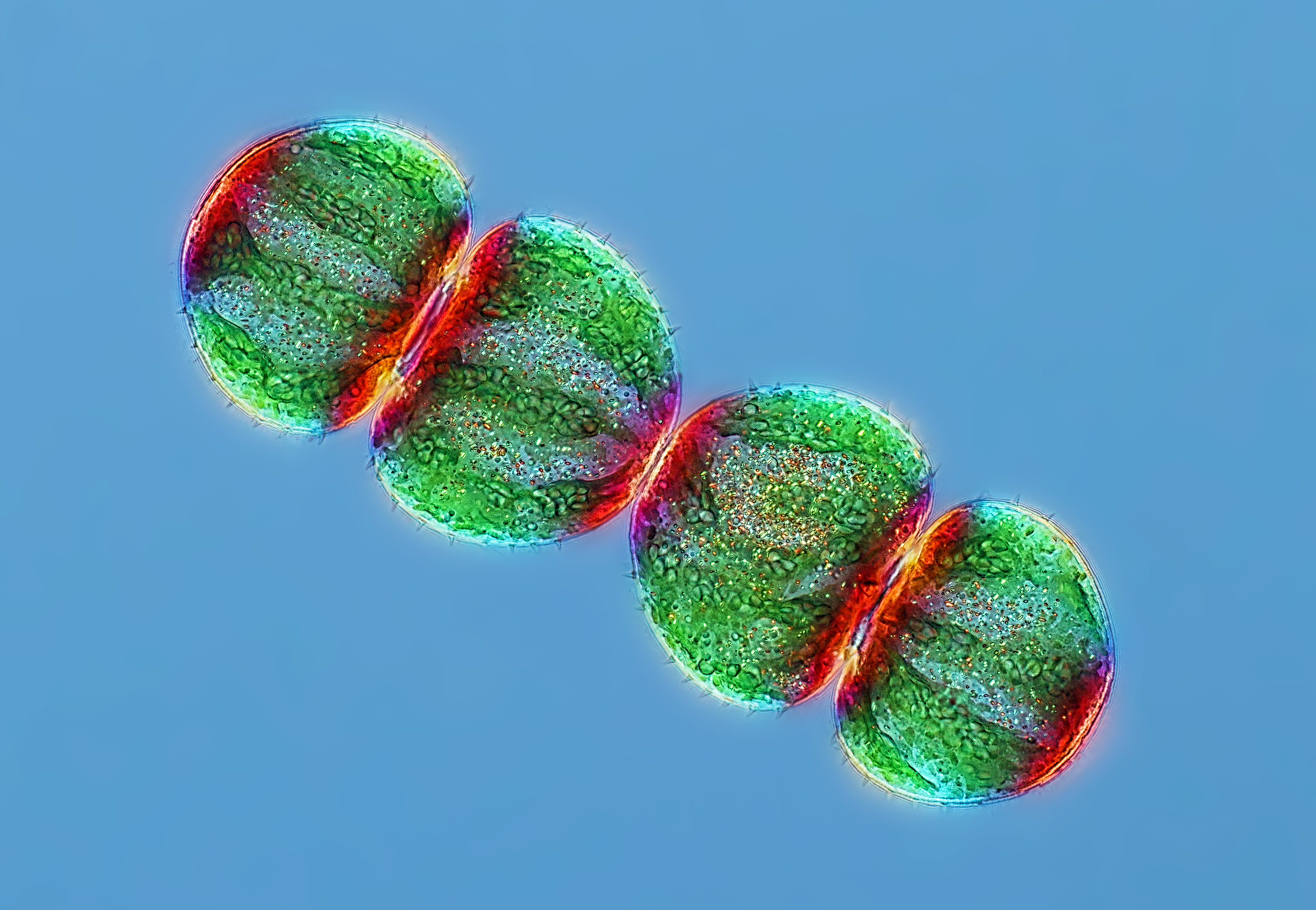 Cell division in microalgae (Cosmarium sp.) | Nikon Small World