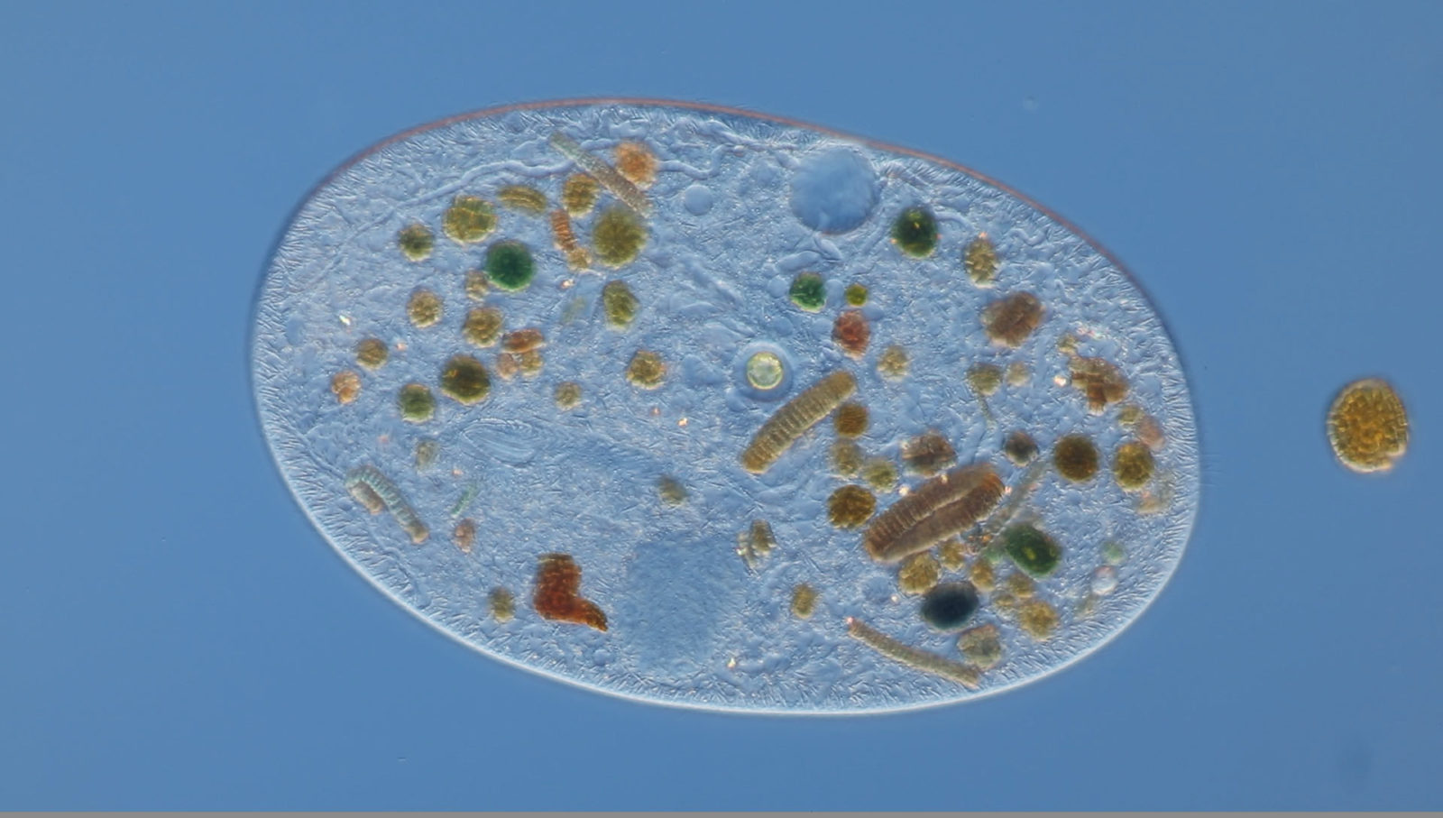 Ciliate (Frontonia) | Nikon Small World