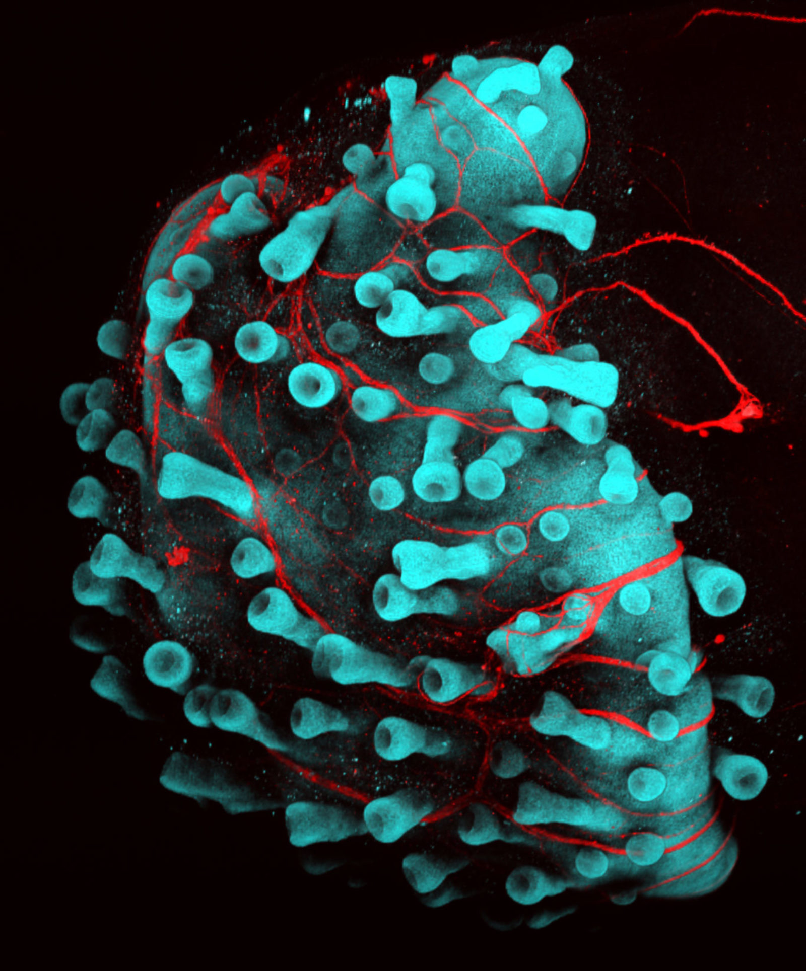Human hair follicles growing from a stem cell-derived skin organoid ...