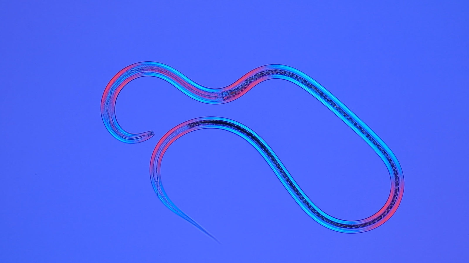 Nematode | Nikon Small World
