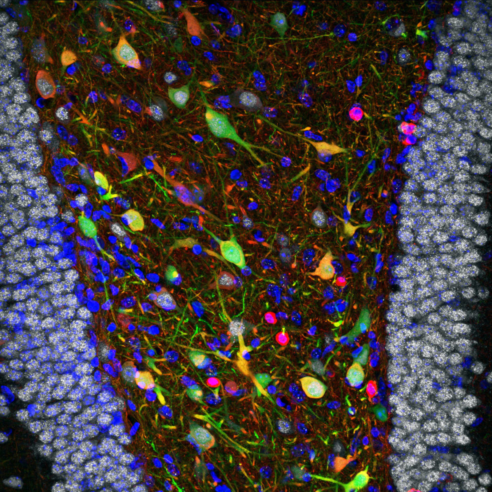 Murine hippocampus showing neurons in white, the microtubule protein ...