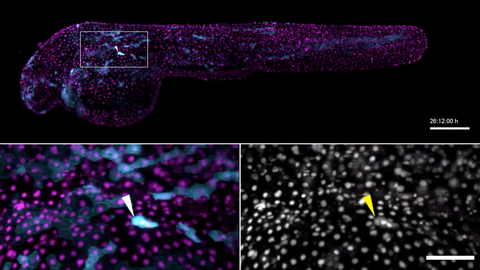 Cancer cell metastasis in a developing zebrafish embryo | Nikon Small World