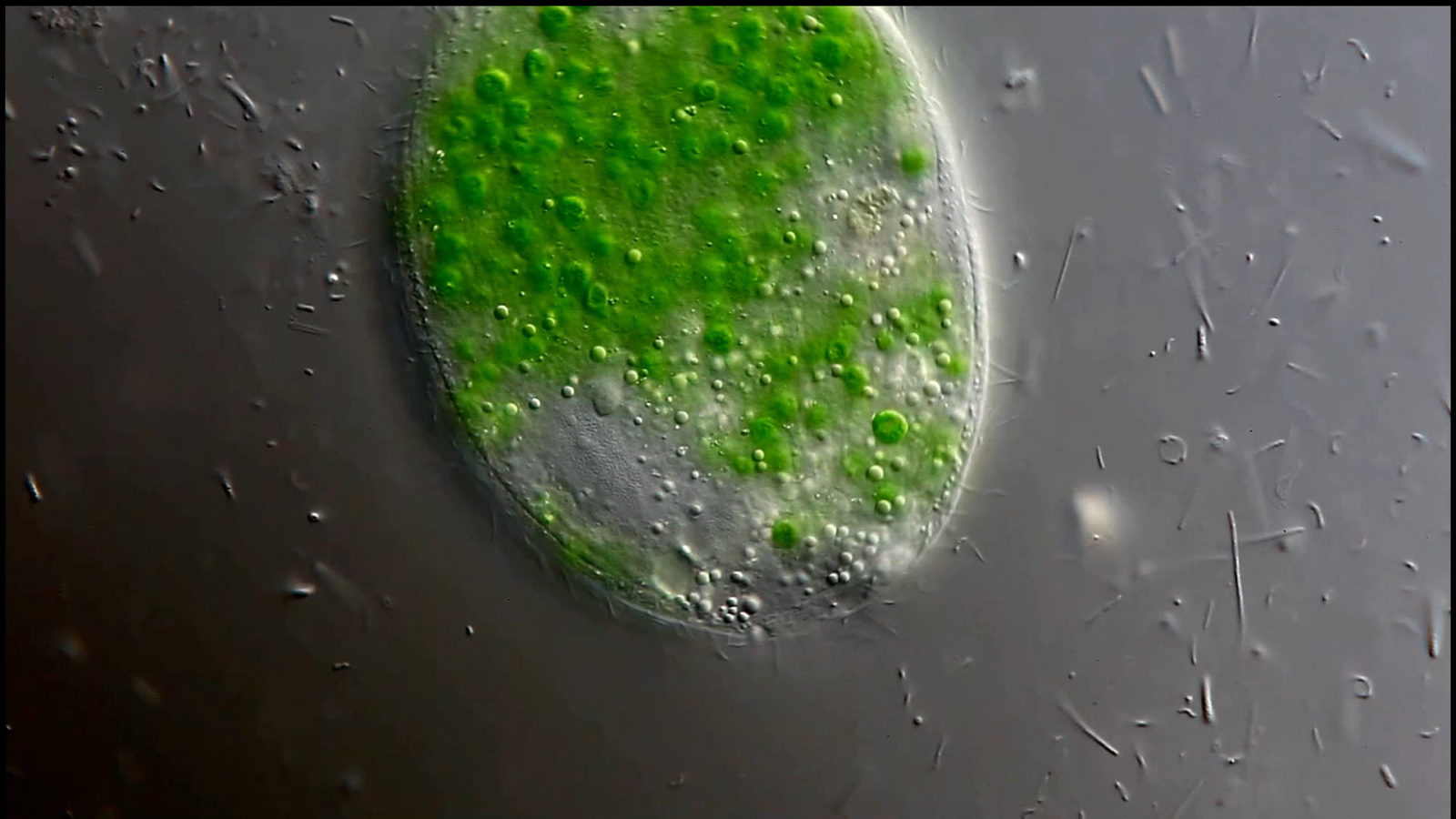 Ciliate (Prorodon viridis) showing its beating cilia and green ...